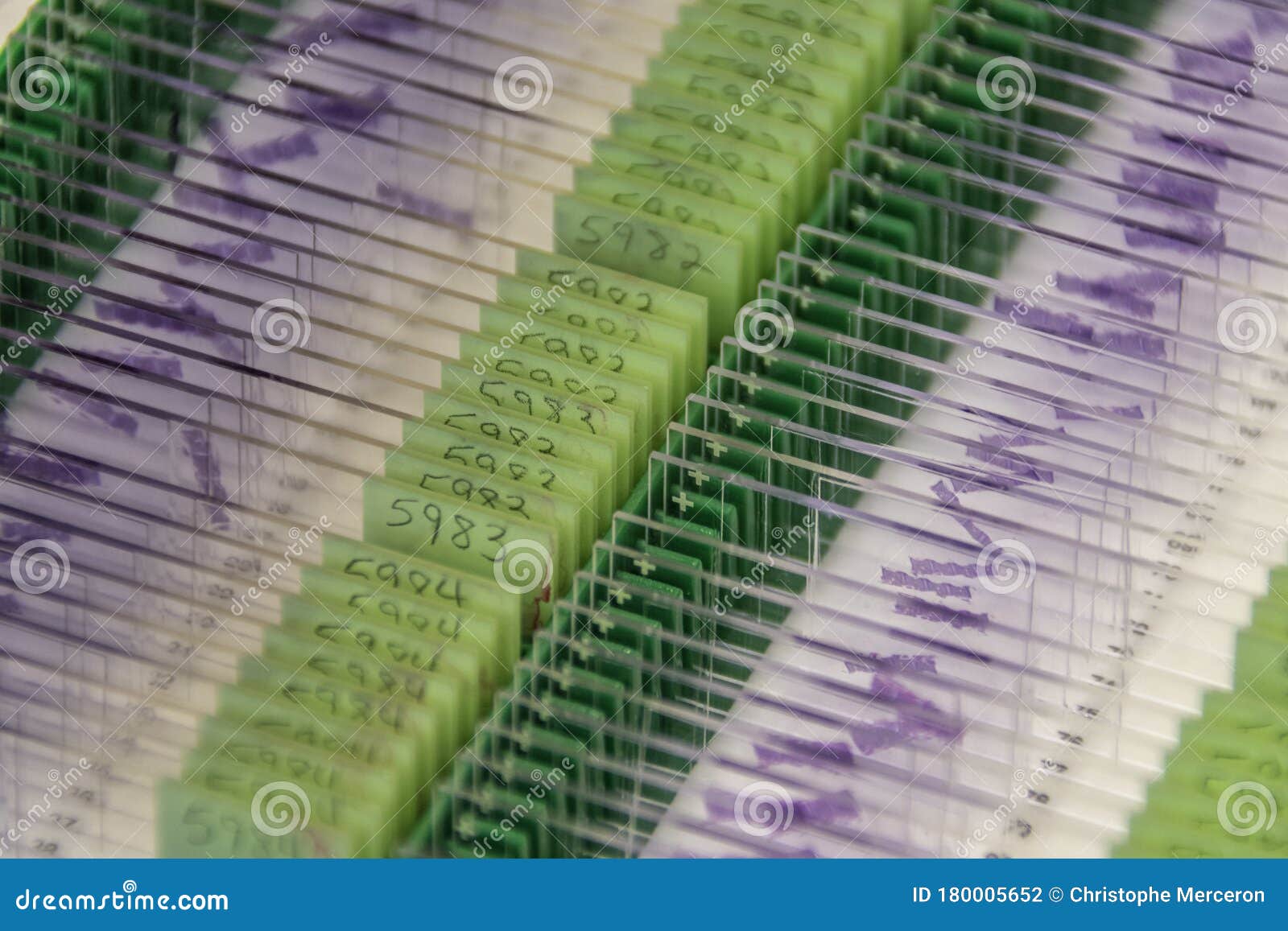 Series of Histology Specimen Slides Stock Photo - Image of chemistry ...