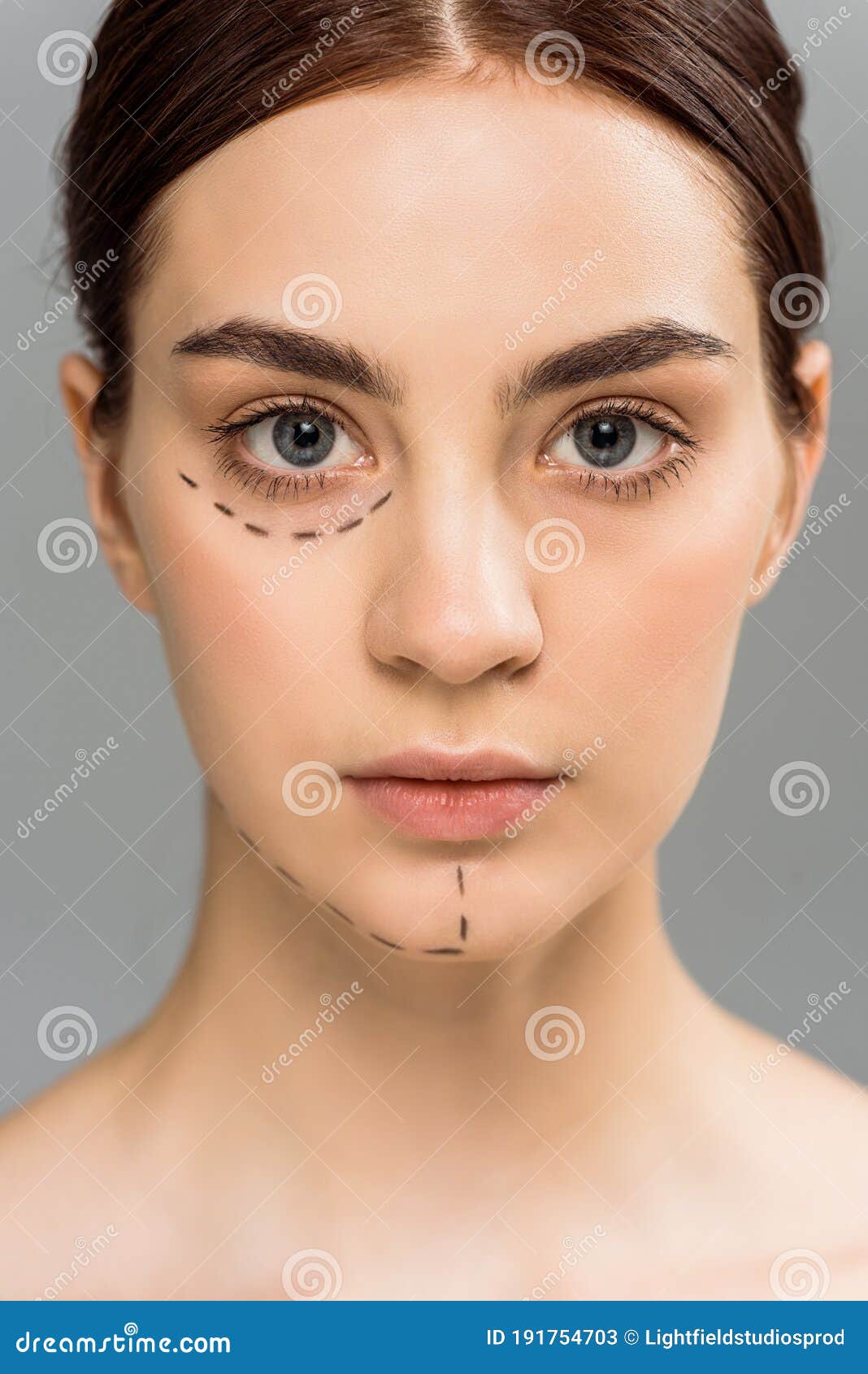 Young Woman with Marks on Face Isolated on Grey Stock Image - Image of ...