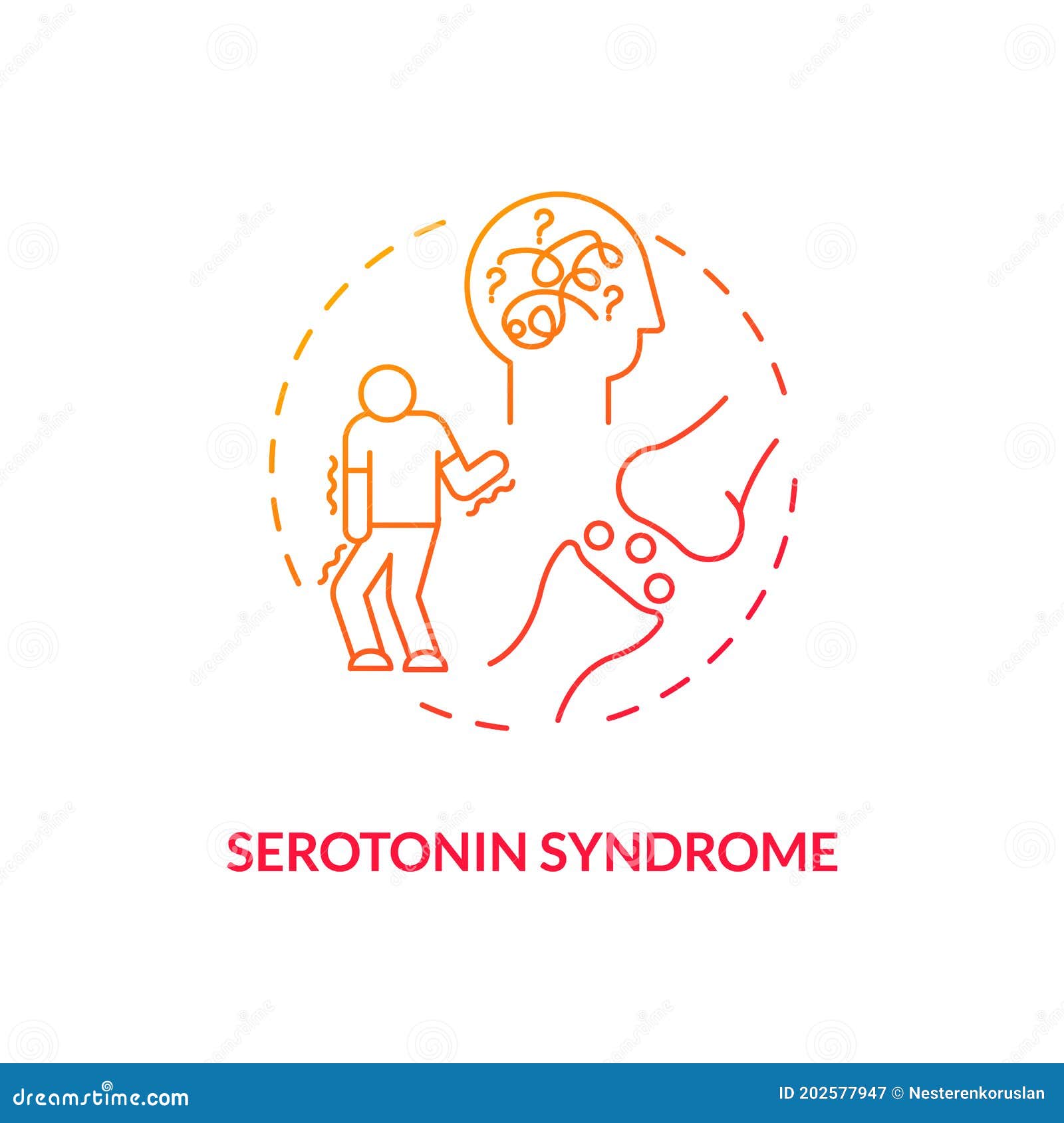 Serotonin Syndrome Vector Illustration With Medical Labeled Symptoms ... Serotonin Syndrome Vector Illustration With Medical Labeled Symptoms ...