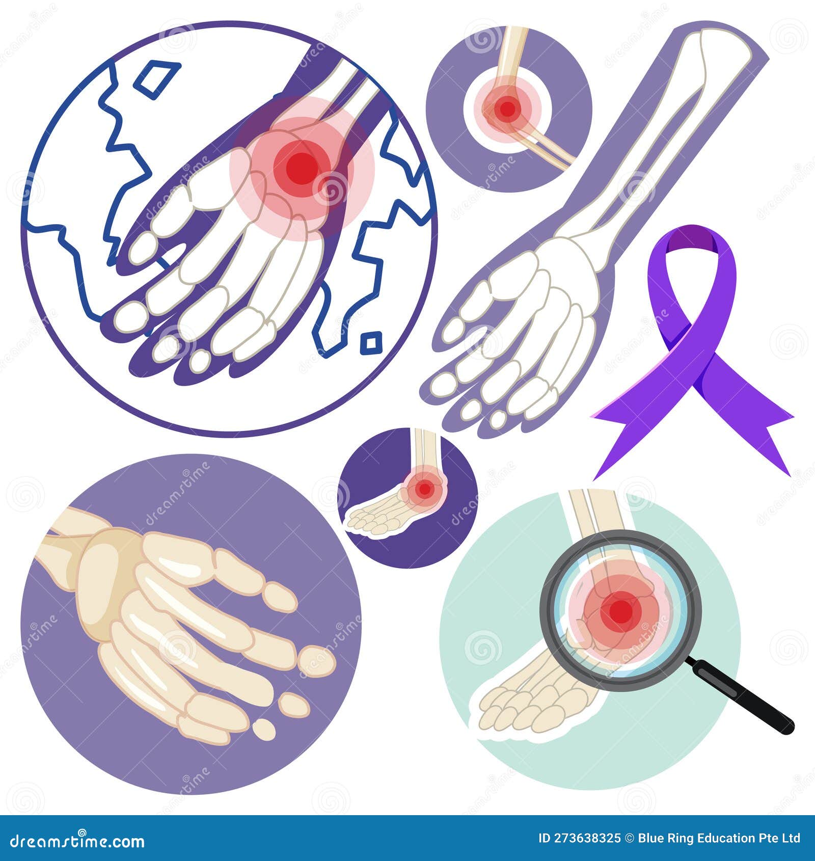 Set of Arthritis sign stock vector. Illustration of person - 273638325