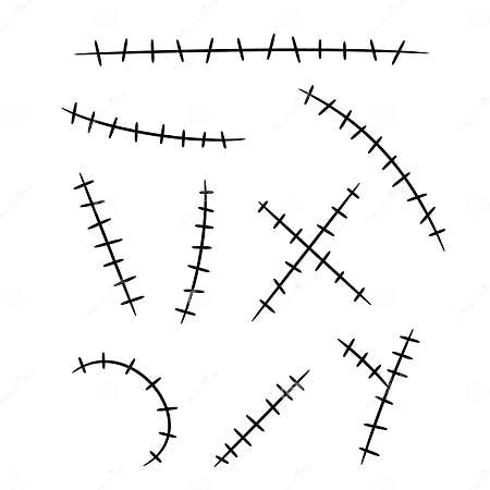 A Set of Black Stitches. Isolated Vector Illustration Stock ...