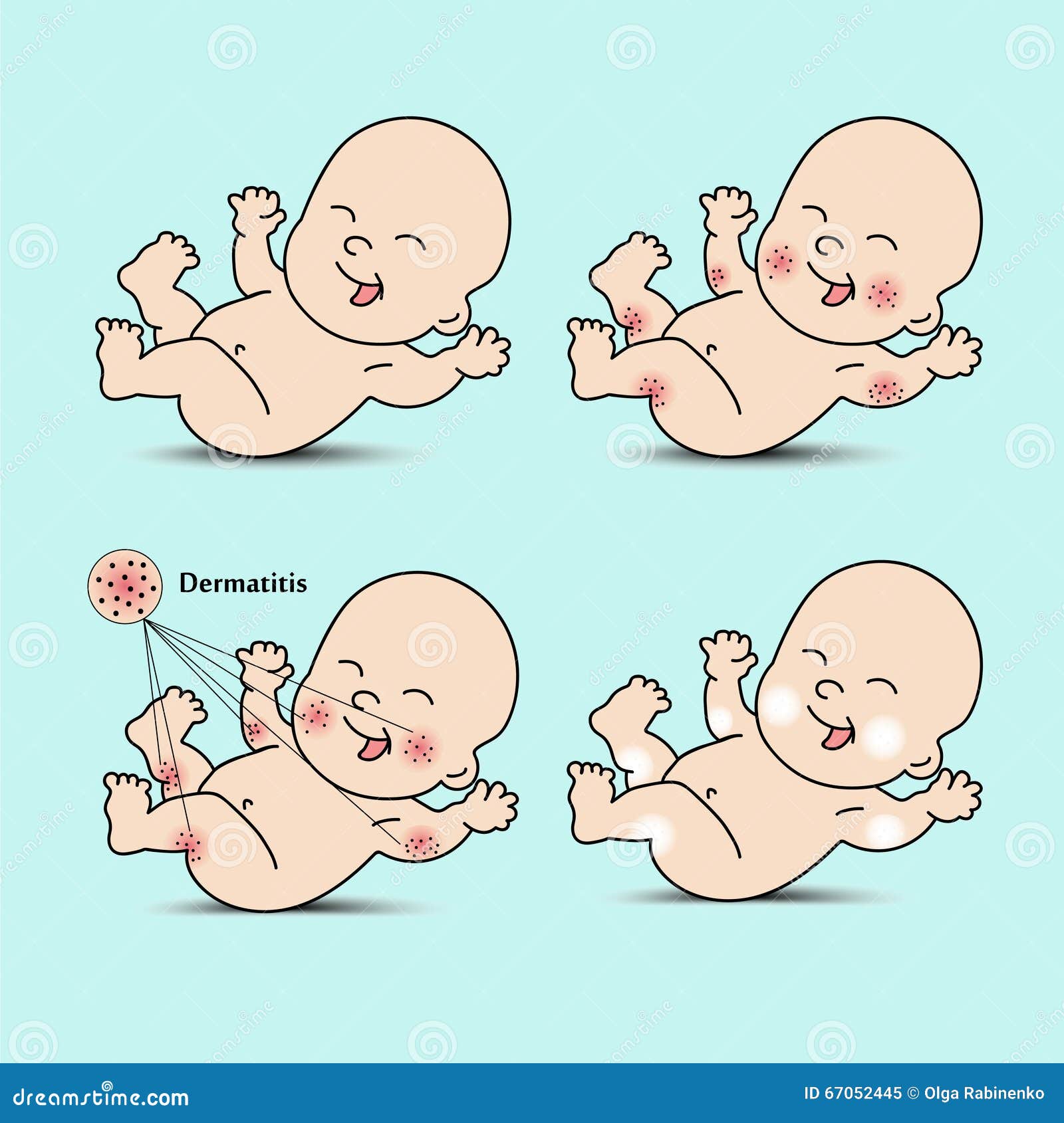 Baby Rash Icon Vector Illustration | CartoonDealer.com #114961418