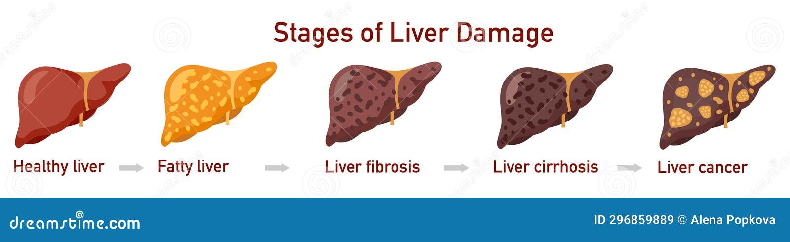Set of Flat Vector Illustrations on the Theme of Medicine. Stages of ...