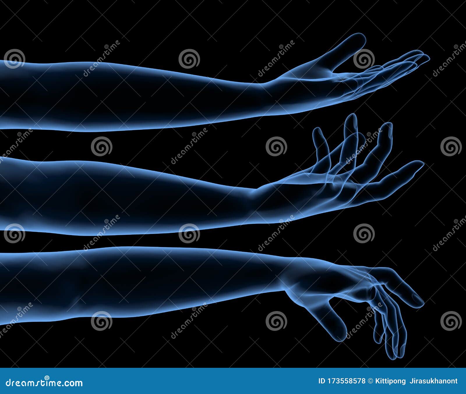 Set of human hands x-ray stock illustration. Illustration of xray ...