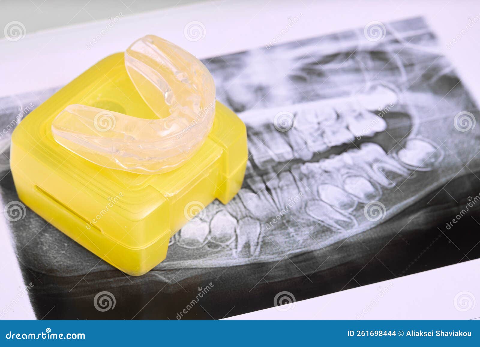 Set of Individual Activator and Aligner for Orthodontic Treatment ...