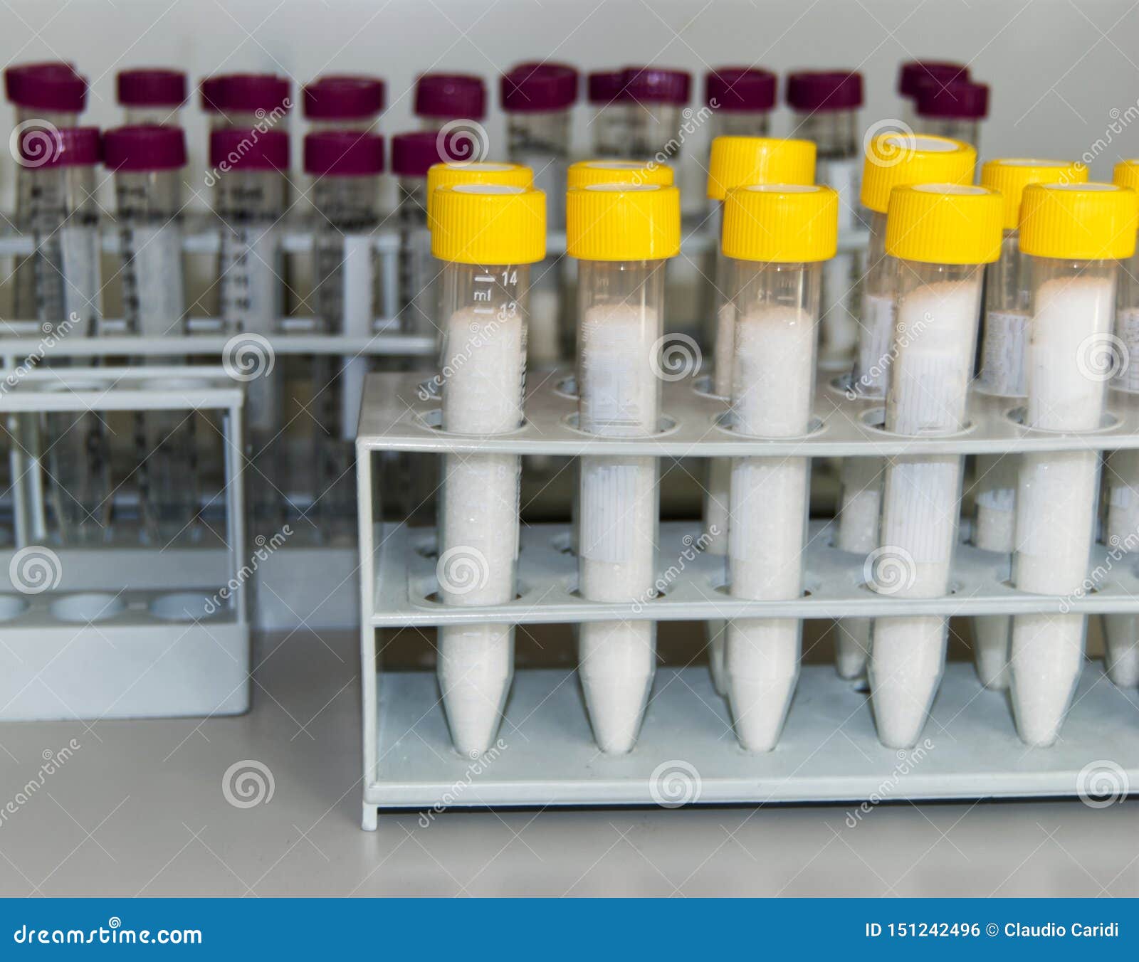 Set of Laboratory Test Tube with Yellow Cap on Display Stock Photo ...