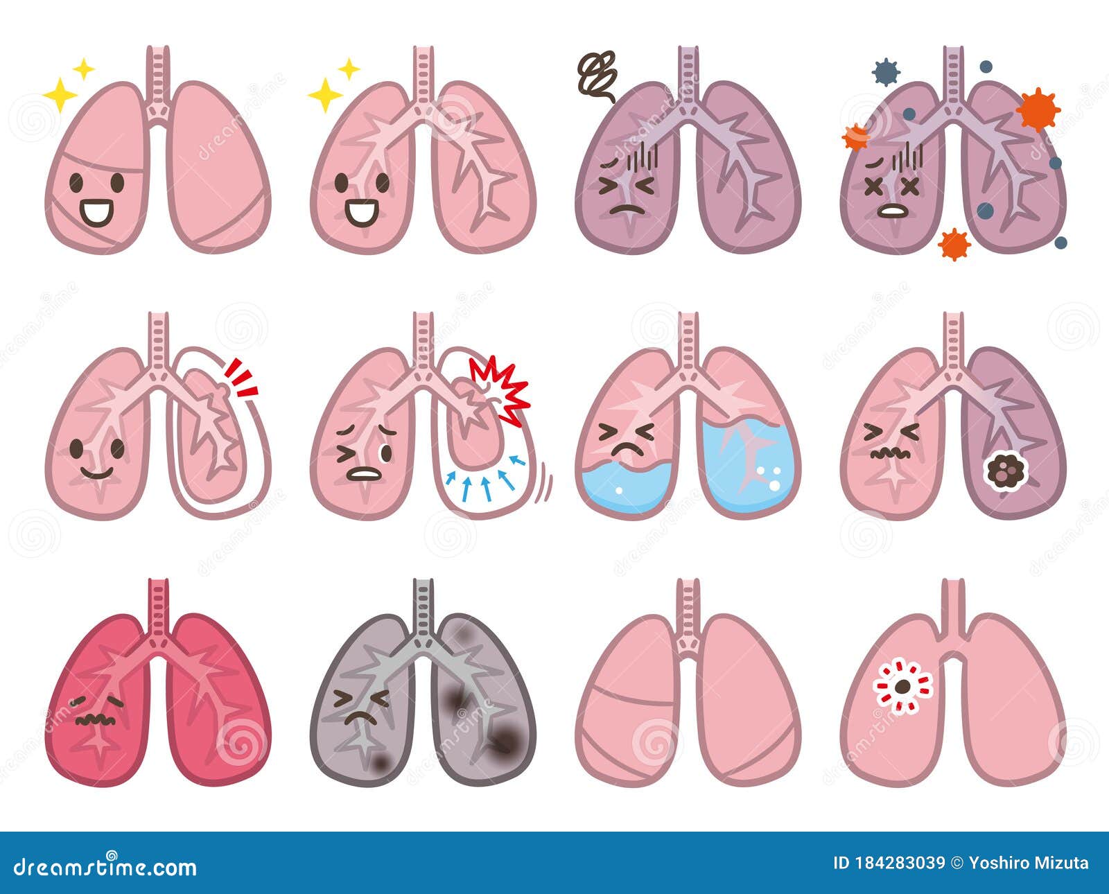 Pulmonary Aspiration Medical Vector Illustration Isolated On White ...