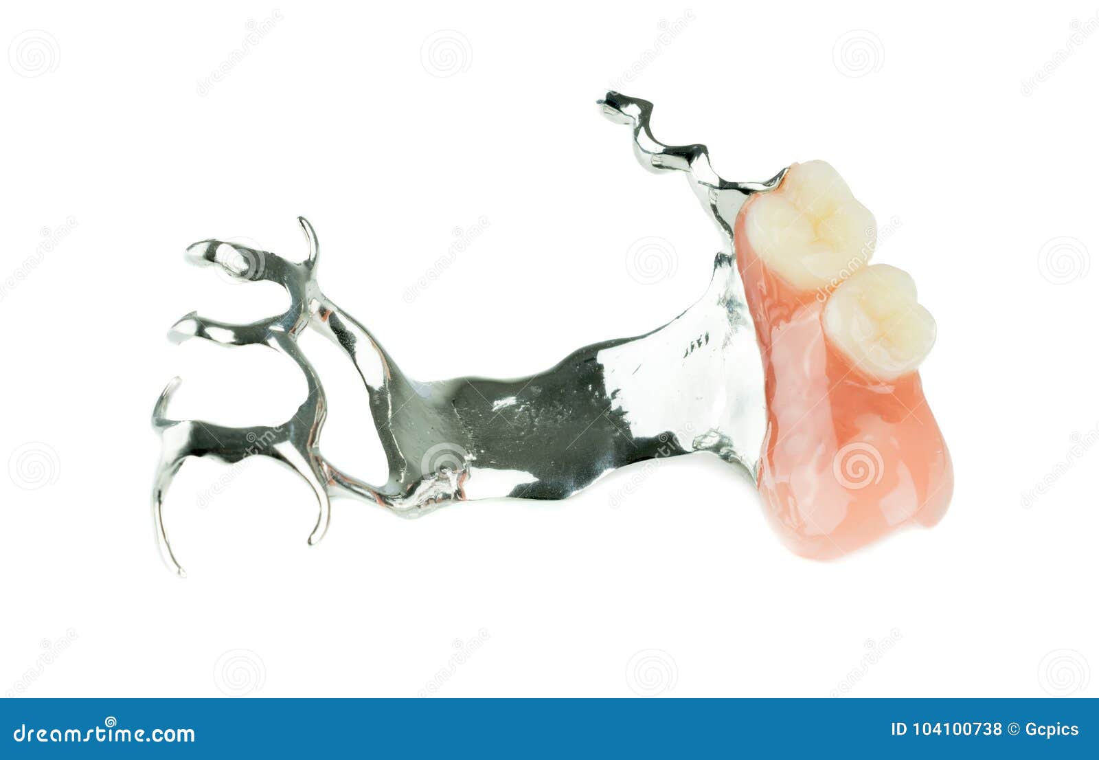 3,511 Metal Dentures Photos - Free & Royalty-Free Stock Photos from ...