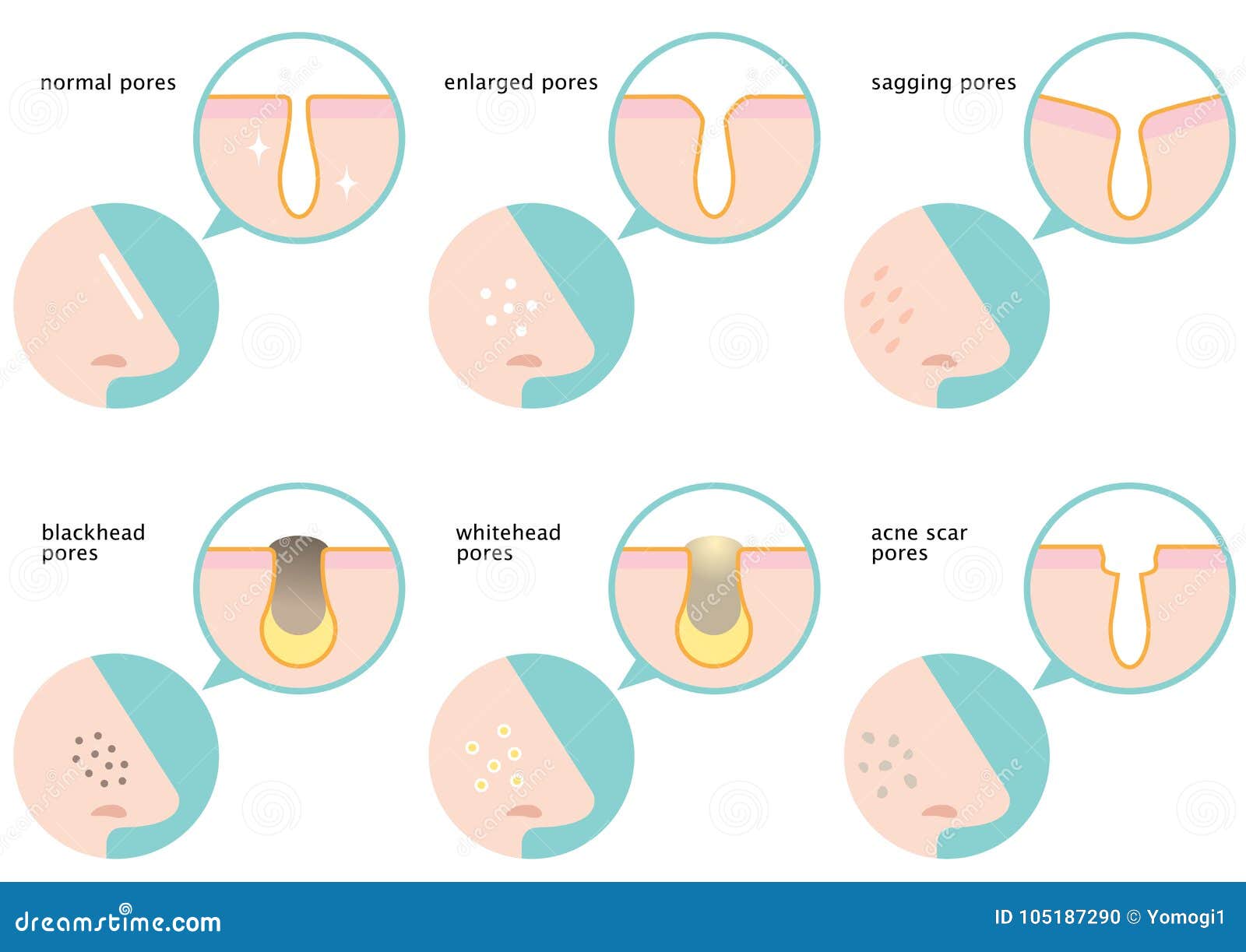 Skin Pores Vector Illustration | CartoonDealer.com #75358188 Skin Pores Vector Illustration | CartoonDealer.com #75358188