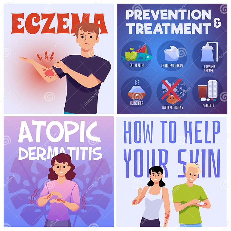Set of Squared Banners about Atopic Dermatitis Flat Style Stock Vector ...