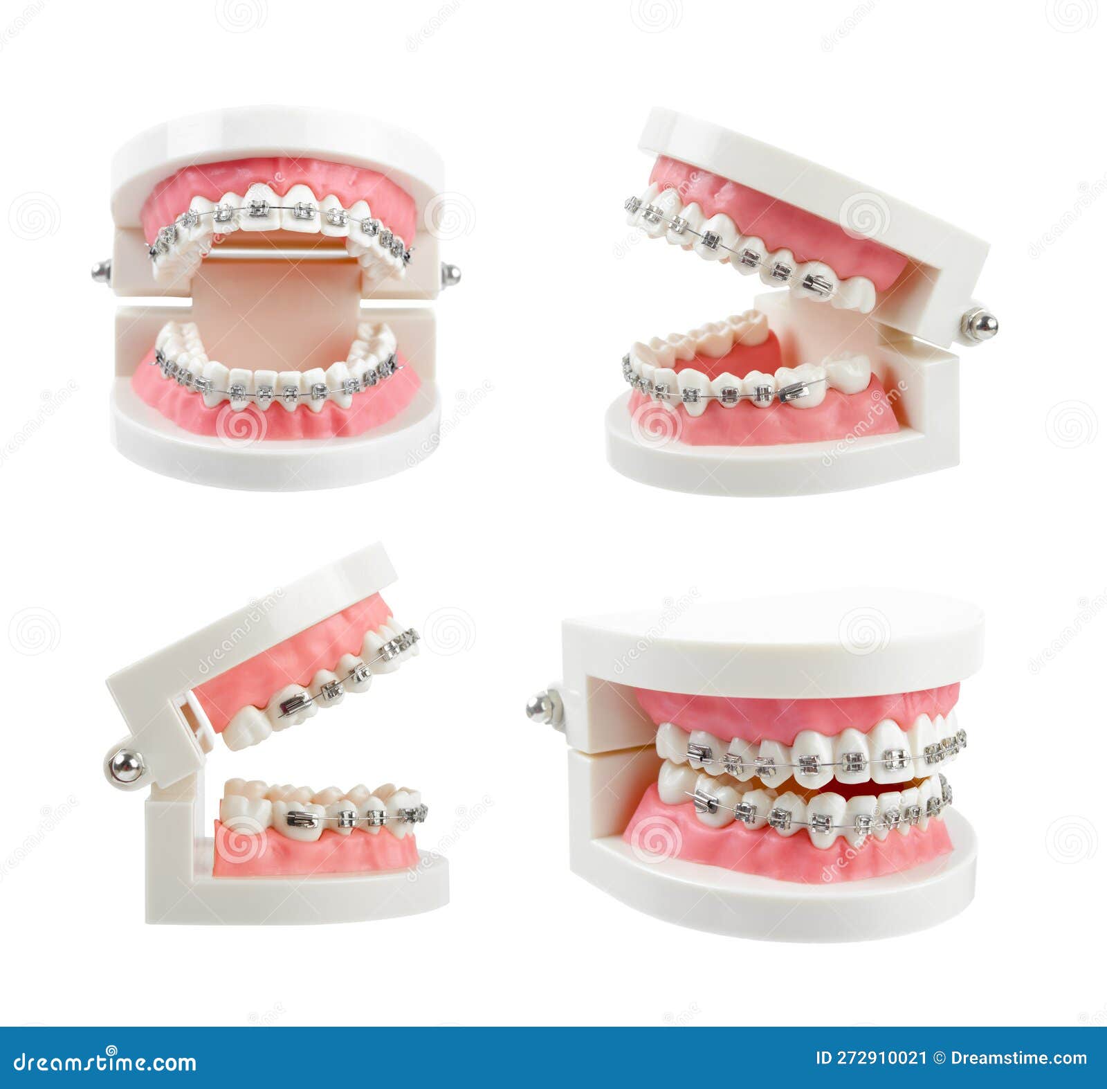 Set of Teeth Model with Metal Wire Dental Braces or Dental Instruments ...