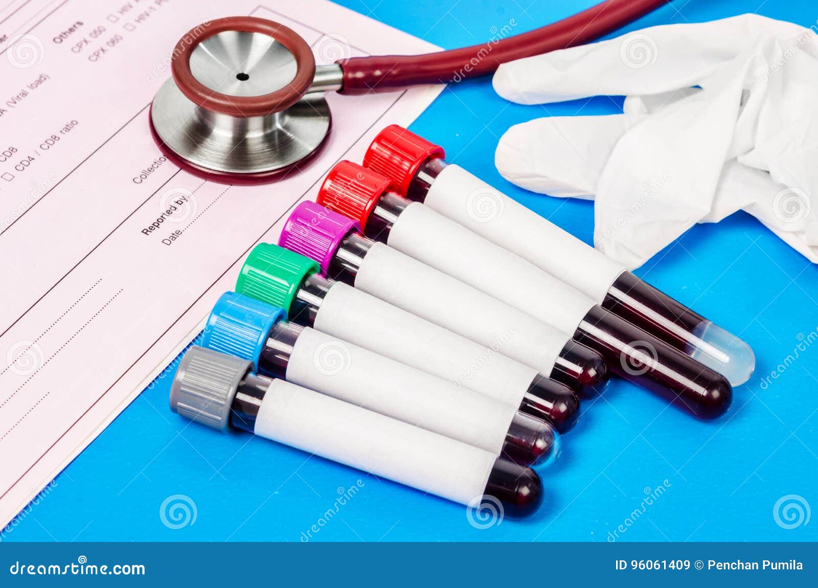 Set of Vacuum Blood Tube with Sample Blood Stock Image - Image of ...