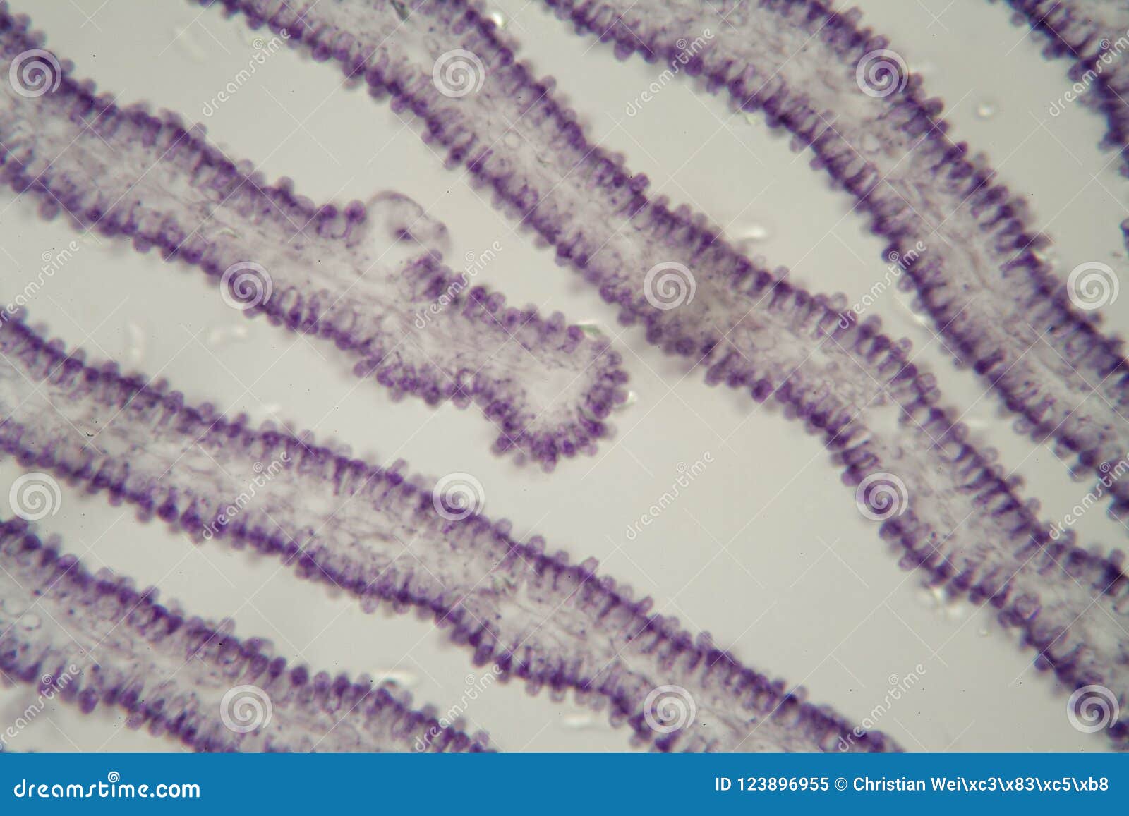 Seta Del Coprinus Debajo Del Microscopio Imagen de archivo - Imagen de ...