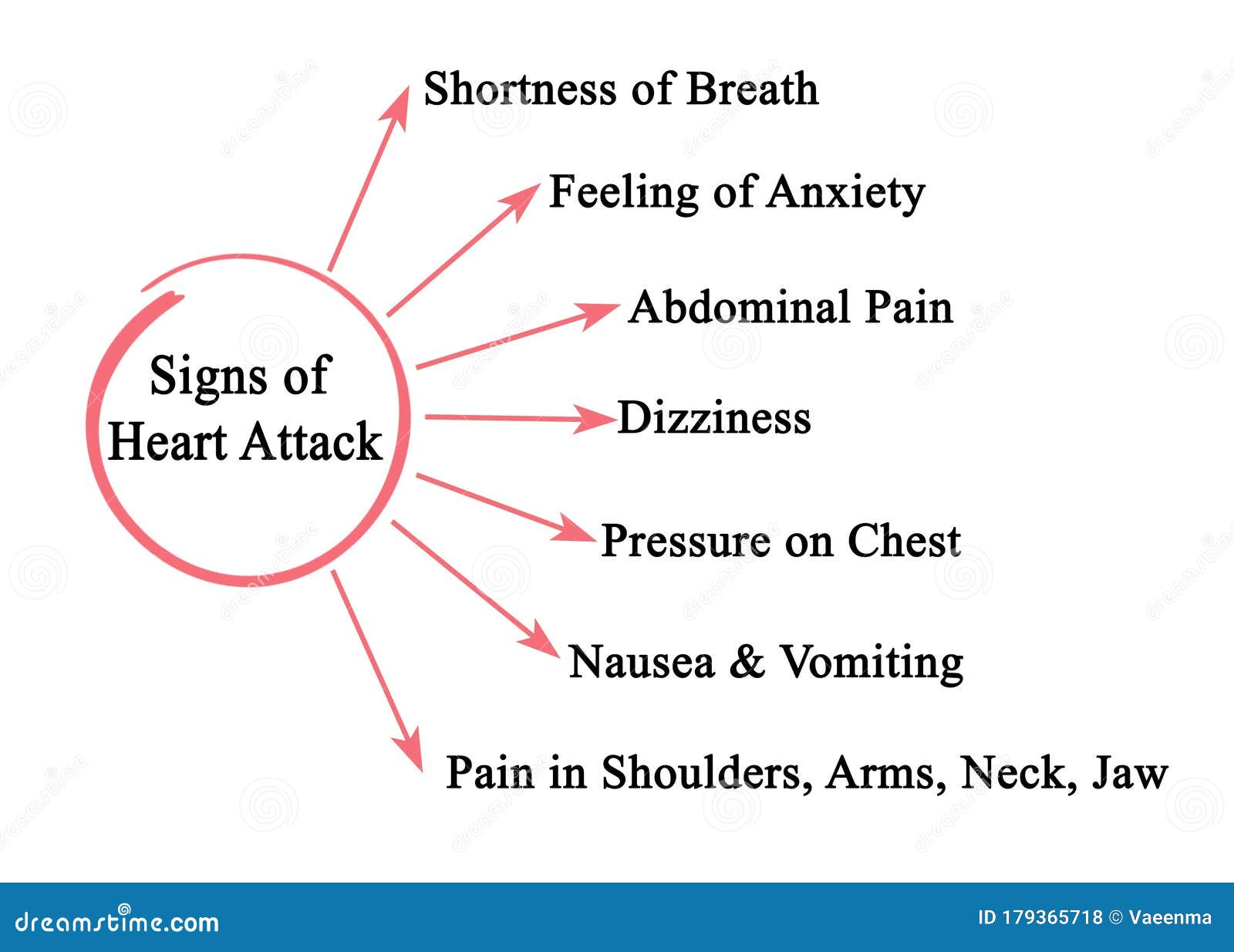 Signs of Heart Attack stock illustration. Illustration of 2032 - 179365718