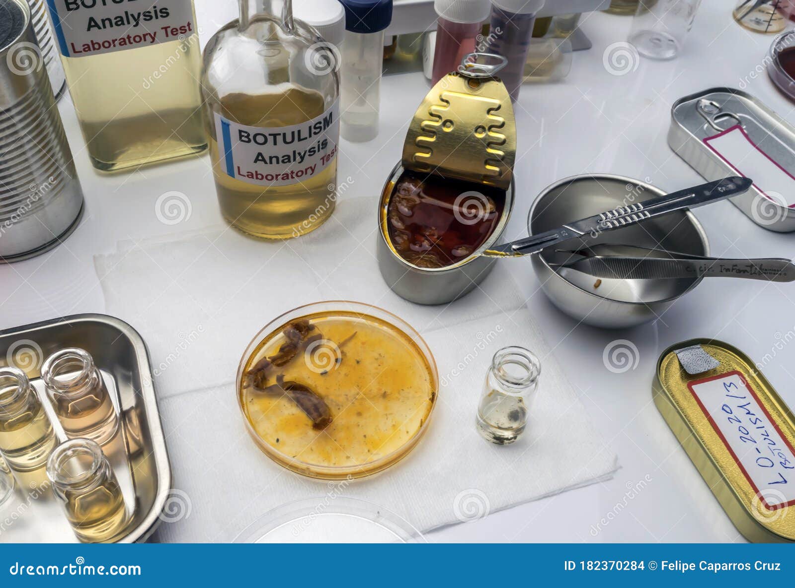 Several Samples of Tin Cans, Botulism Infection in Sick People Stock ...