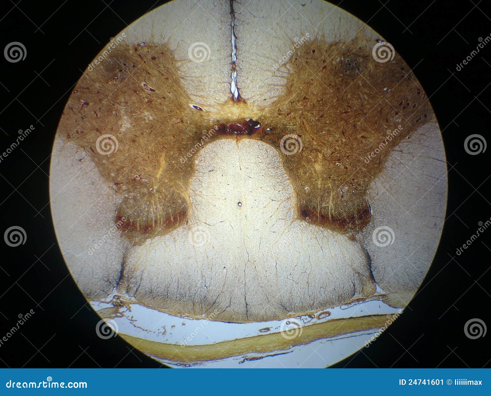 Sezione Trasversale Del Midollo Spinale Immagine Stock - Immagine di ...