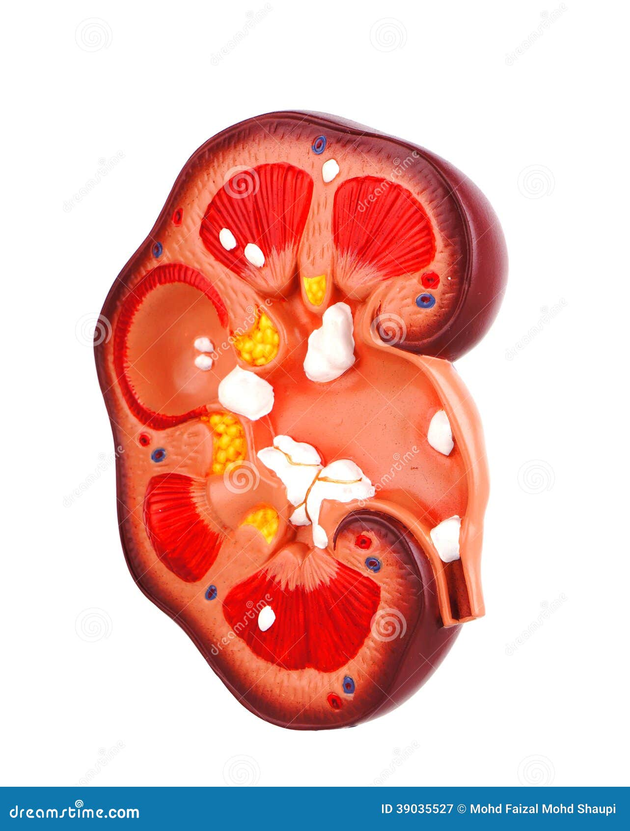 Sezione Trasversale Del Rene Umano Immagine Stock - Immagine di malato ...