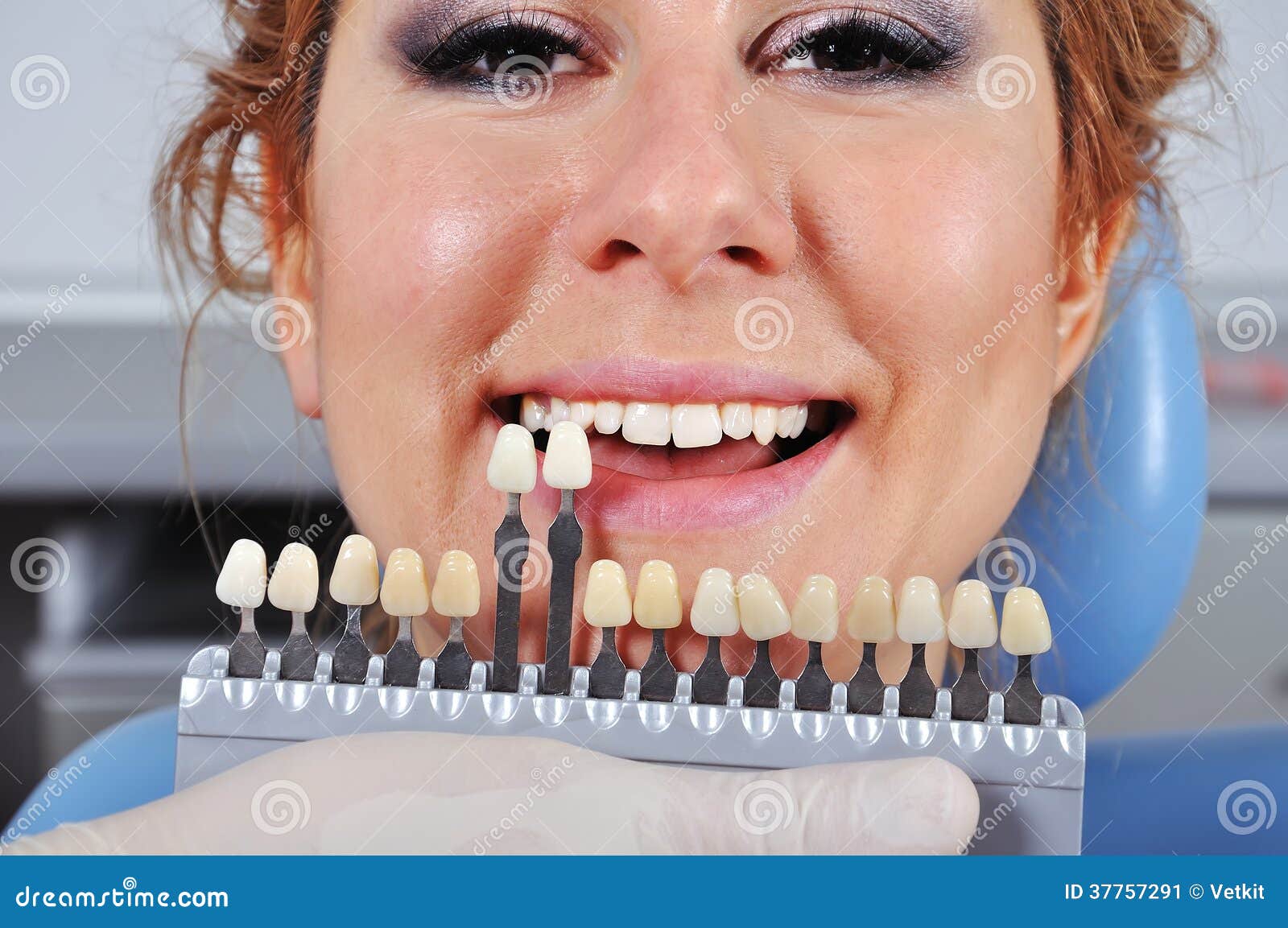 Shade determination tooth stock image. Image of medicine - 37757291