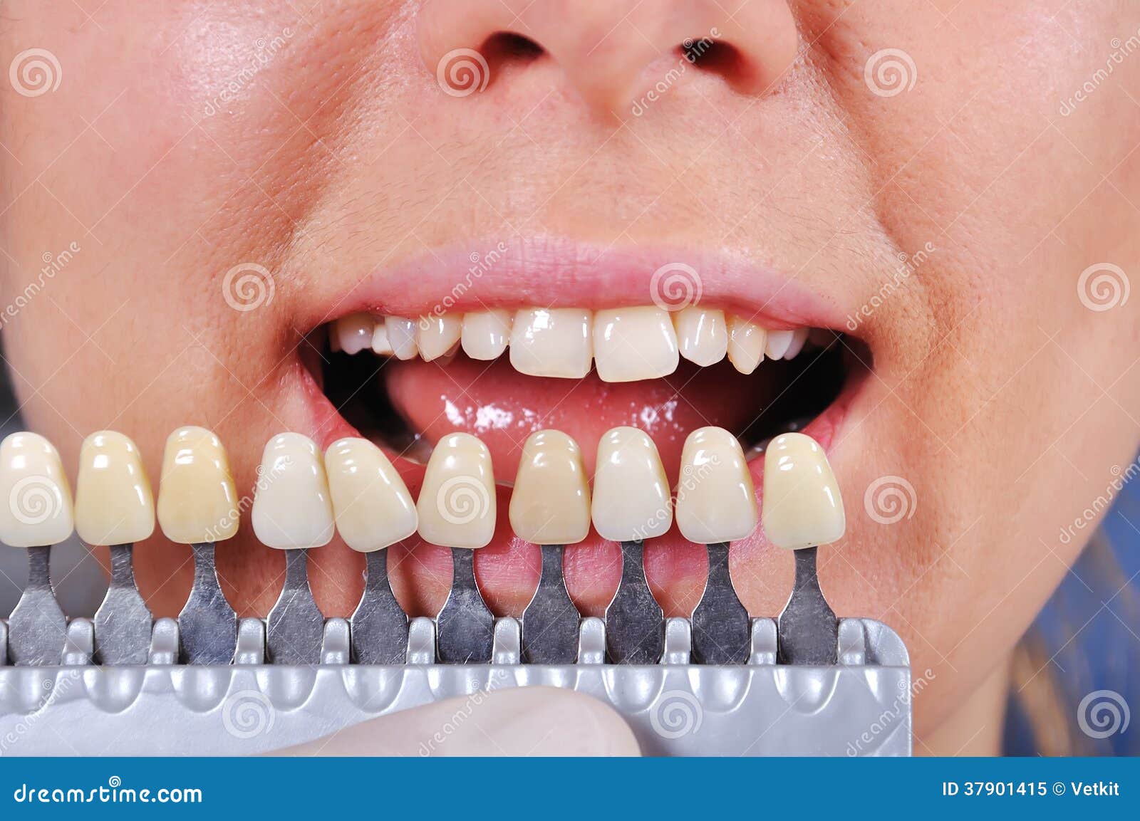 Shade determination tooth stock image. Image of dentistry - 37901415