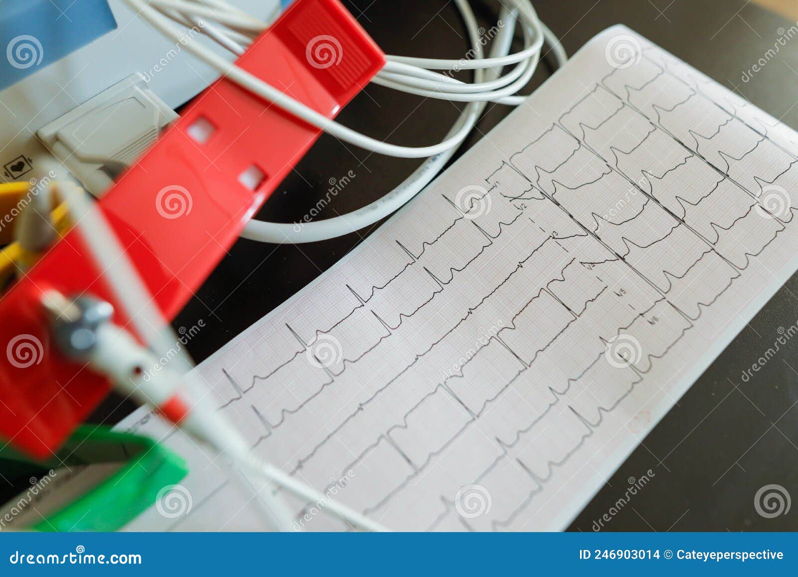 ECG Electrodes On Electrocardiogram Royalty-Free Stock Image ...