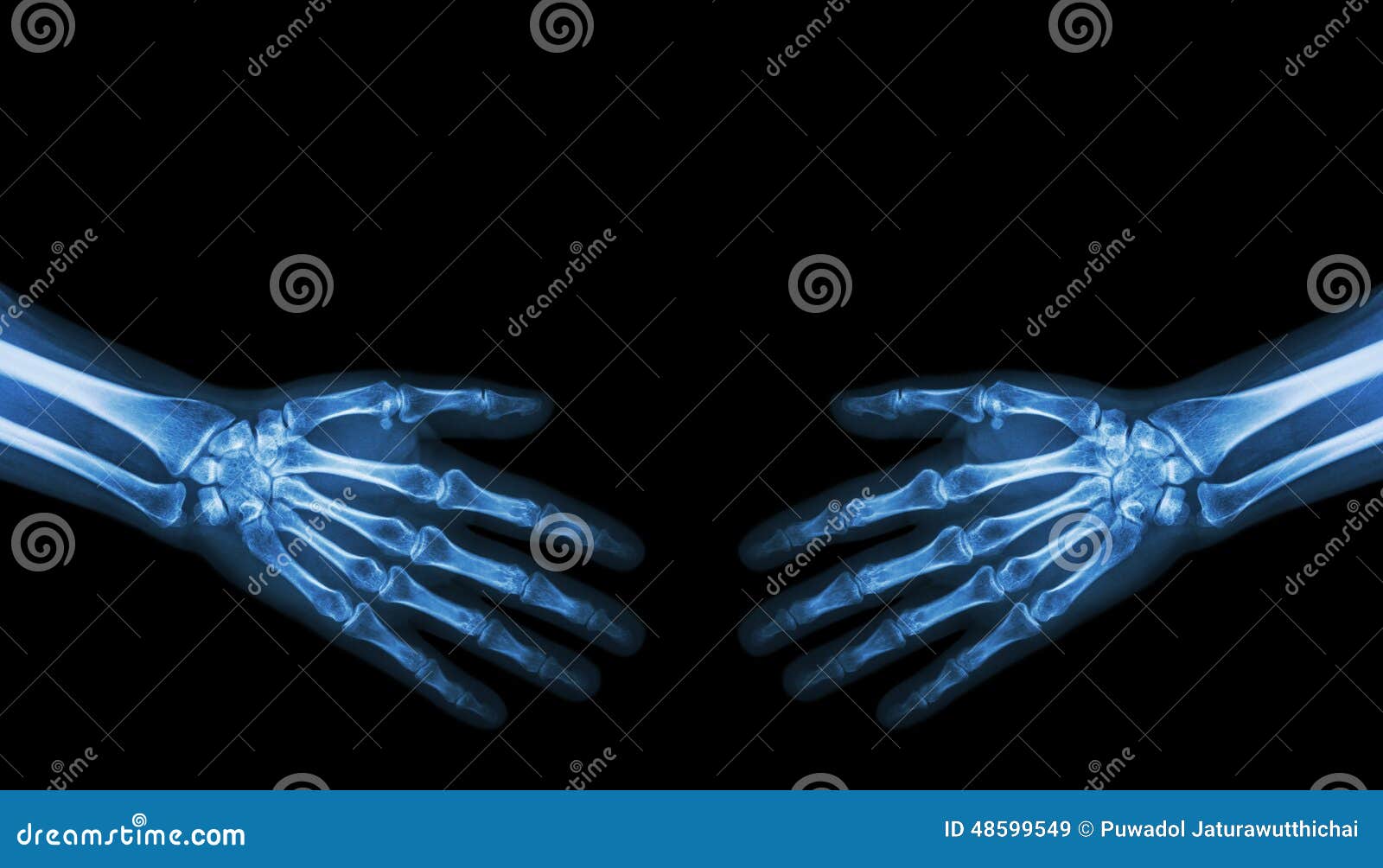 X Ray Hand Normal