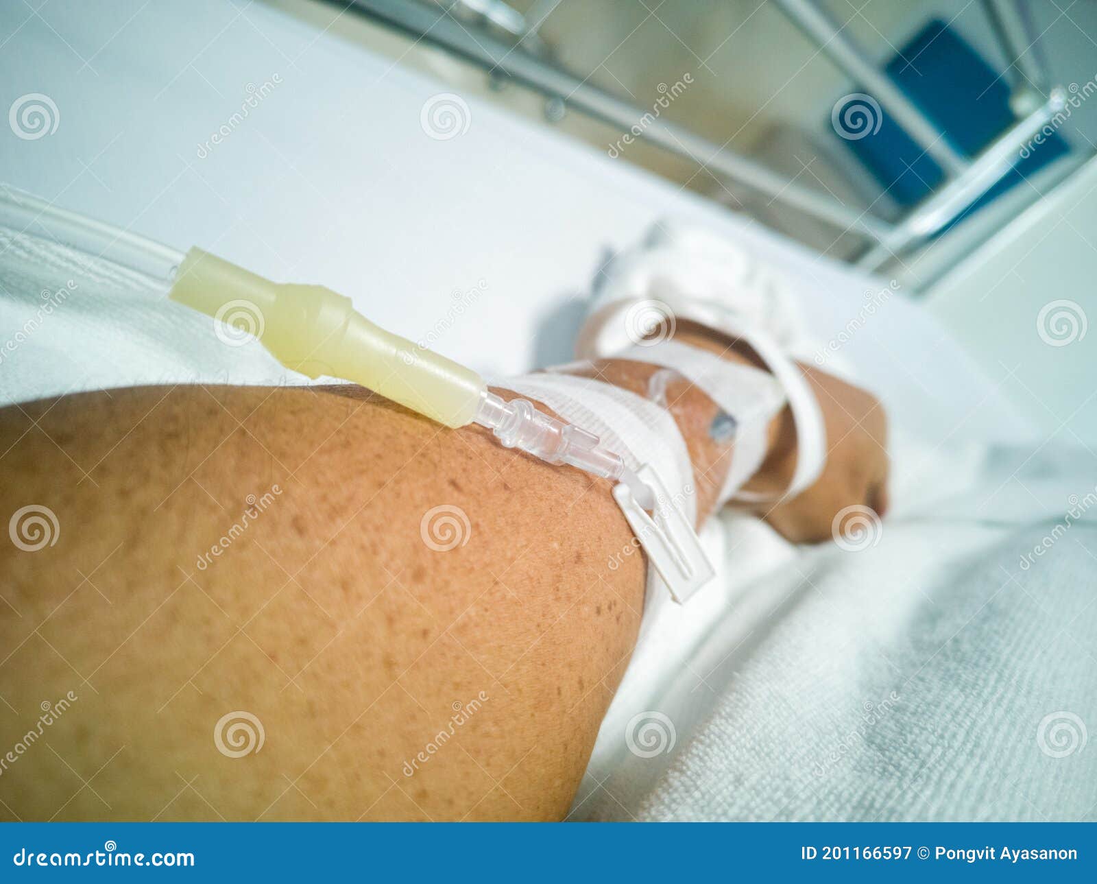 Shallow Depth of Field Shot of Iv Drip in Patient`s Hand, Infusion Drip ... Shallow Depth of Field Shot of Iv Drip in Patient`s Hand, Infusion Drip ...