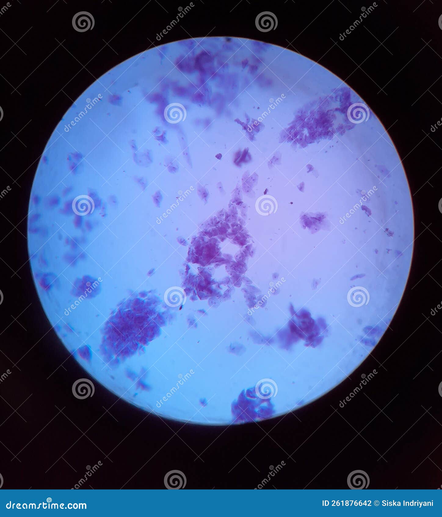 The Shape of Epithelial Cells Using a Light Microscope Stock Photo ...