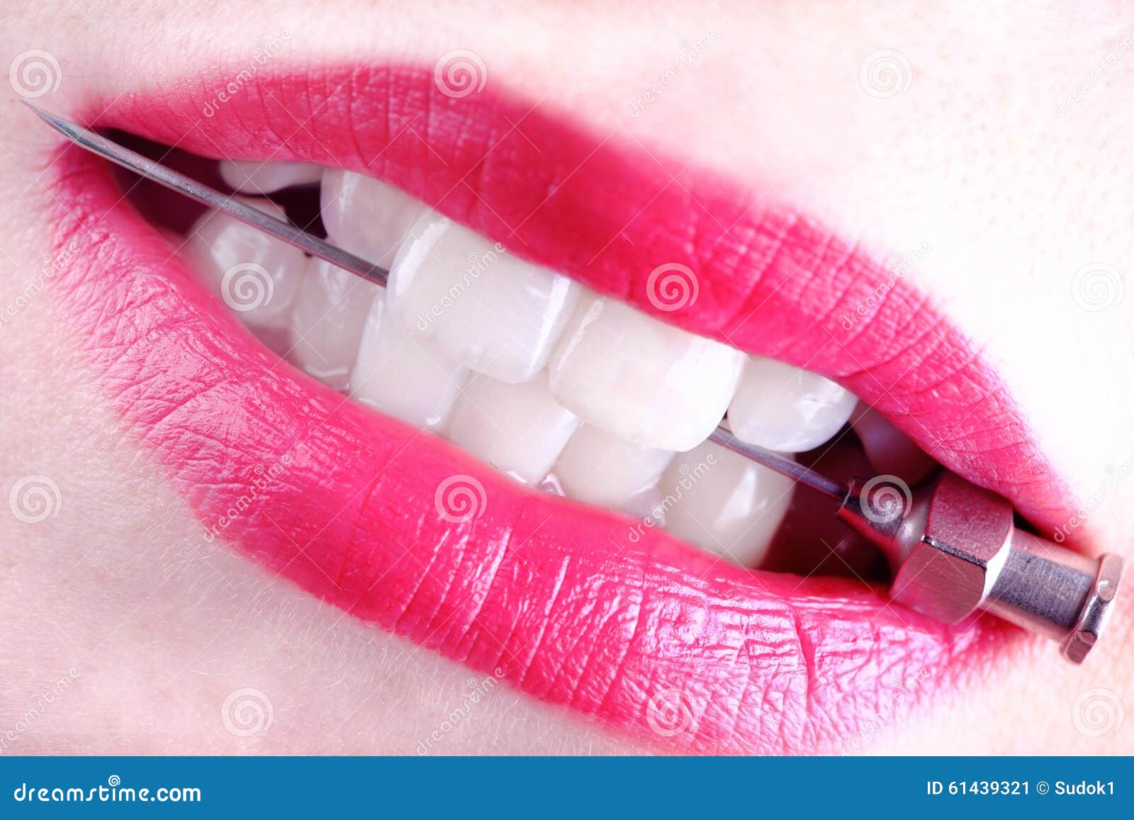 Sharp Medical Needle in the White Teeth of a Young Woman Stock Image ...