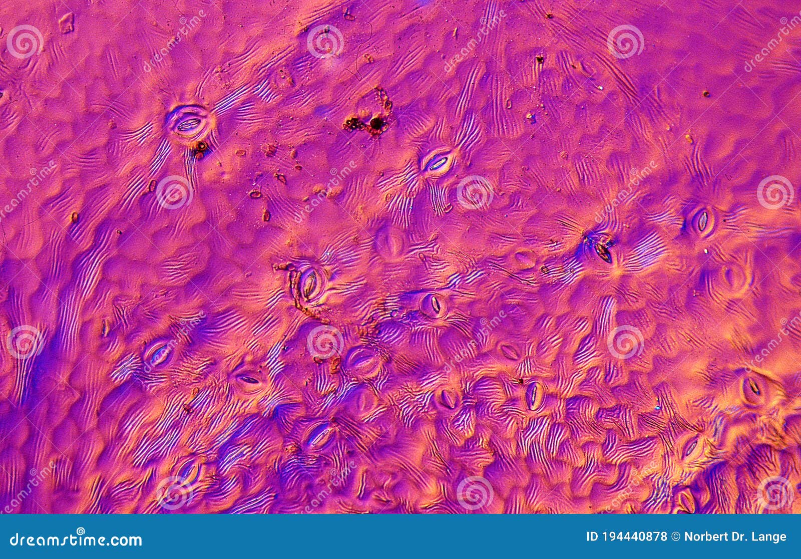 Fibrocartilage Connective Tissue 400x