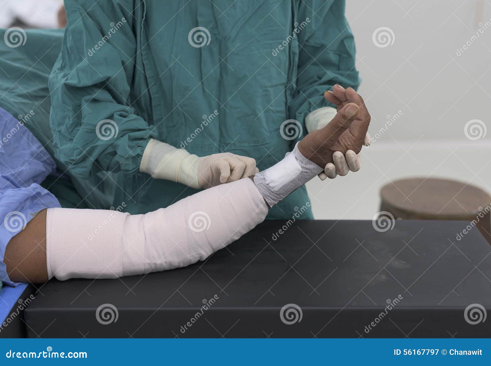 Short arm slab stock image. Image of hand, medical, insurance - 56167797