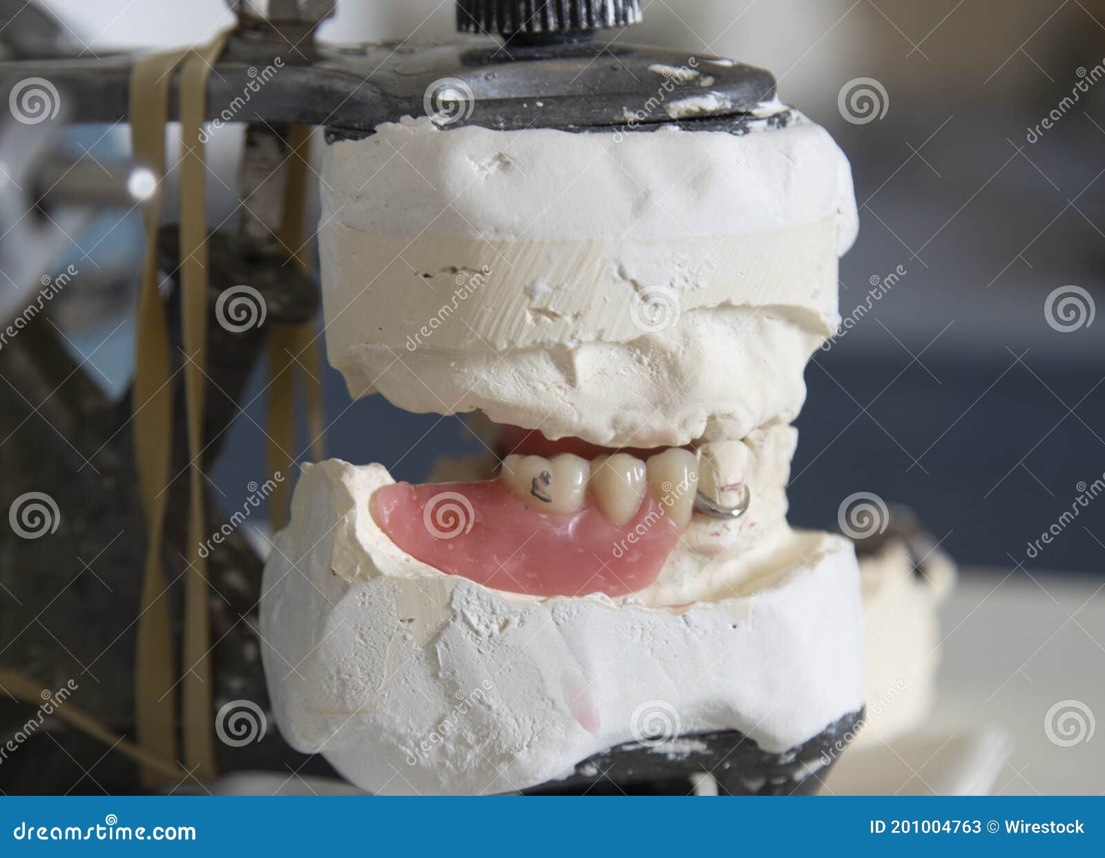 Shot of Dental Impression Molds for Reconstruction Stock Image - Image ...