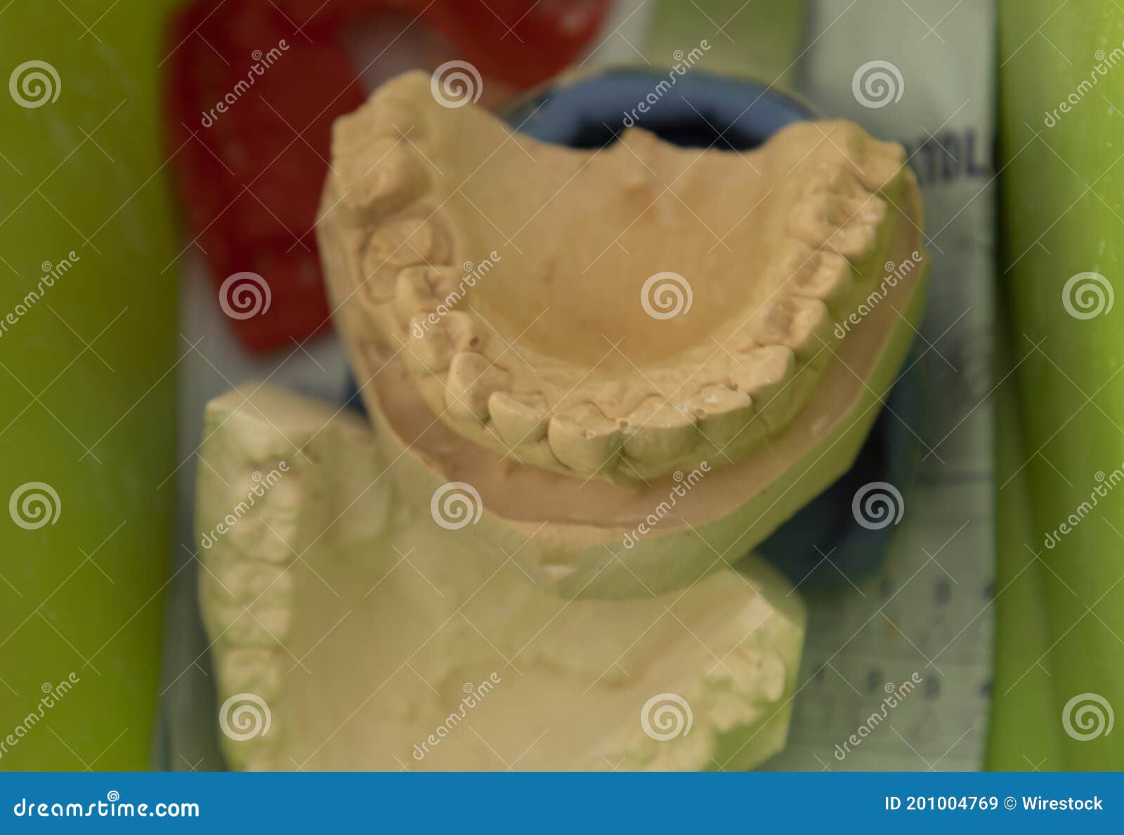 Shot of Dental Impression Molds for Reconstruction Stock Image - Image ...