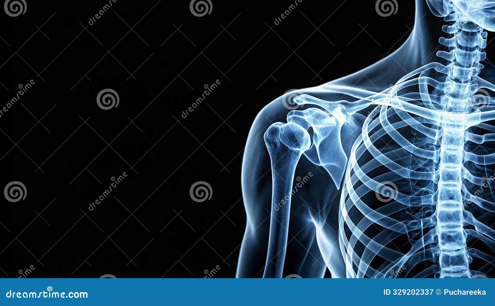 Shoulder Blade X Ray with Detailed Scapula Bones on a Solid Black ...