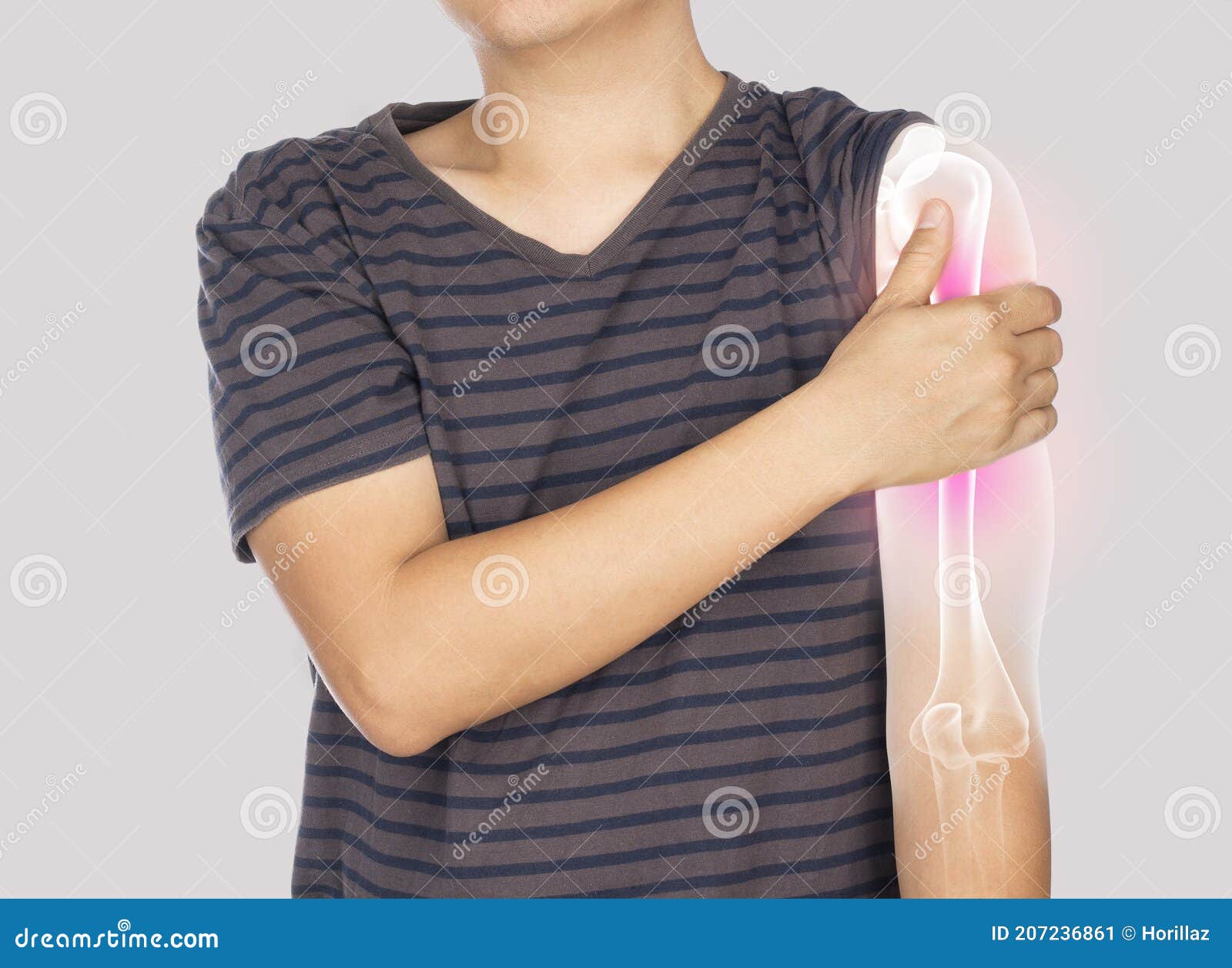 Shoulder Bone Pain on Gray Background Shoulder Injury Stock Image ...