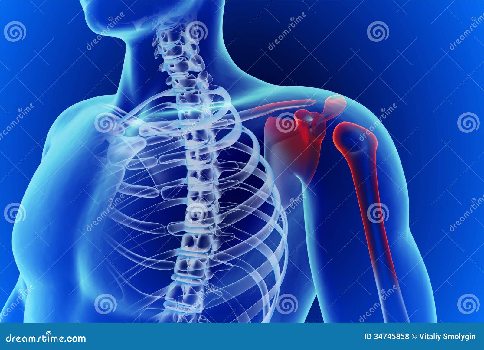 Shoulder inflammation stock illustration. Illustration of cage - 34745858