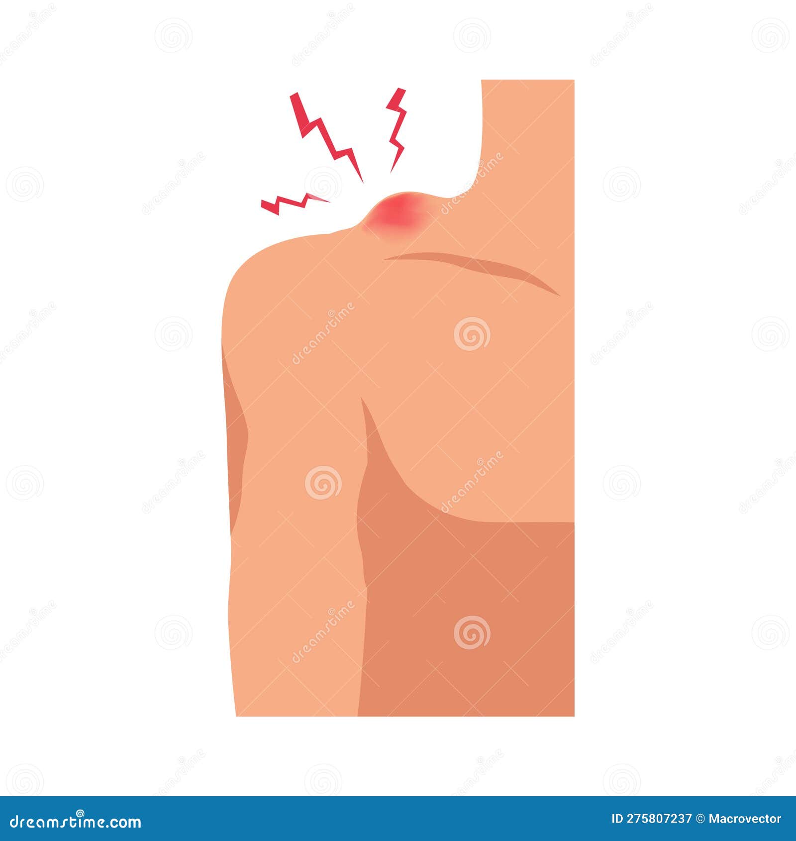 Shoulder Injury Illustration Cartoon Vector | CartoonDealer.com #275802217