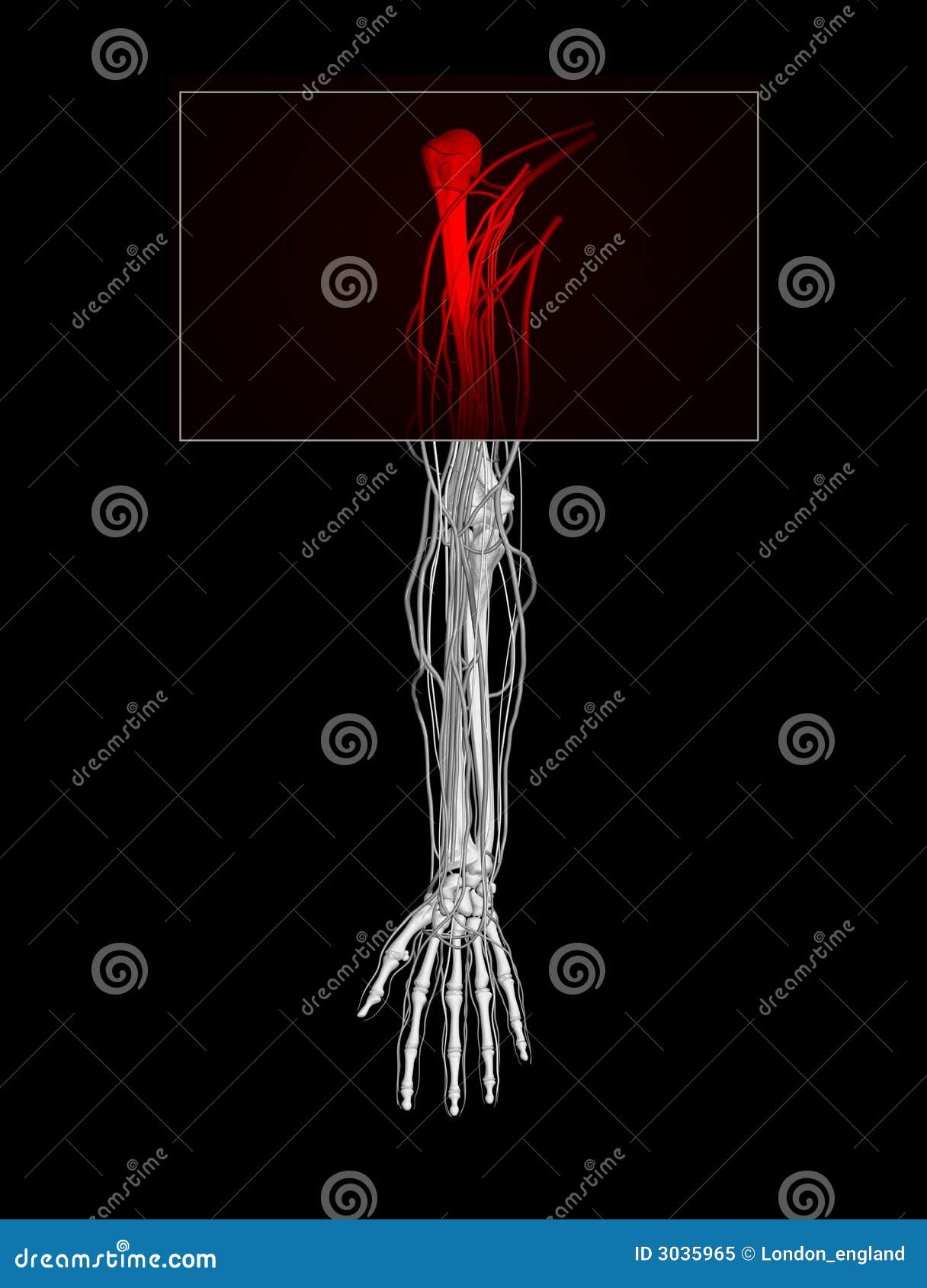 Broken Shoulder Stock Illustrations – 558 Broken Shoulder Stock ...