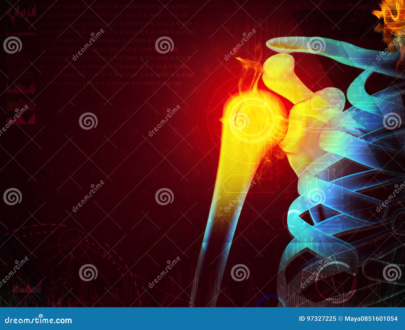Shoulder Pain with the Anatomy of a Skeleton Stock Illustration ...