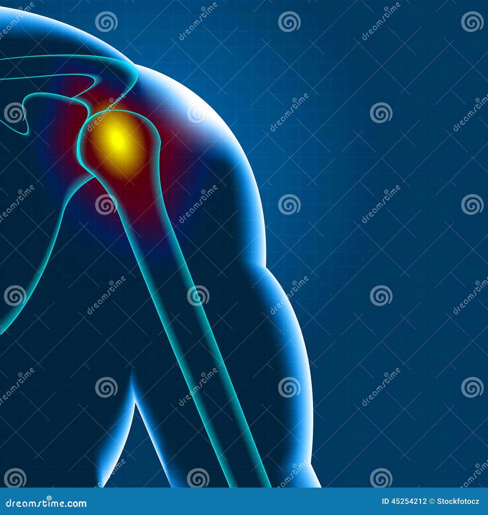 Shoulder pain stock vector. Illustration of health, biology - 45254212