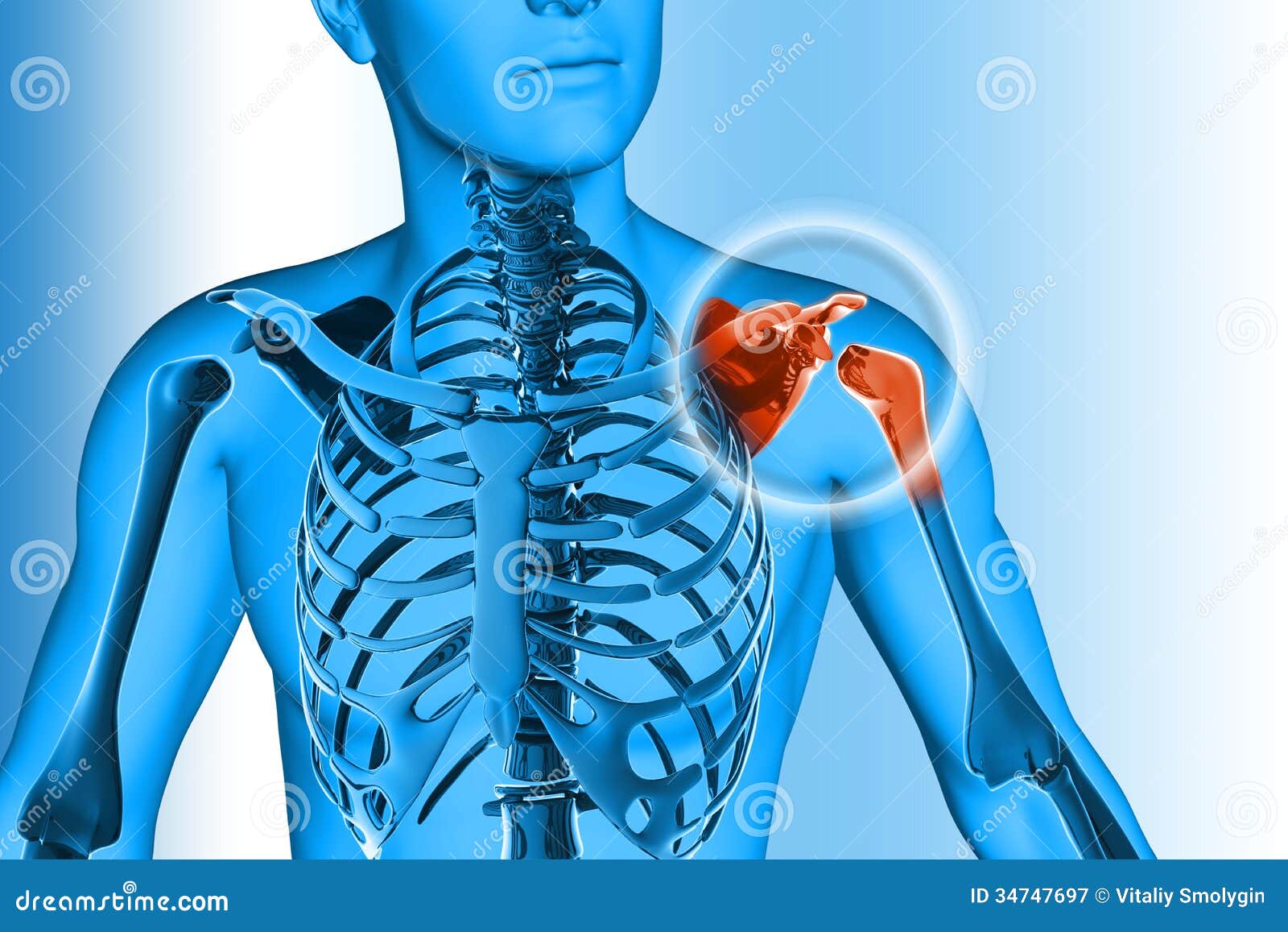 Shoulder Pain - Hurt Trauma Stock Illustration - Illustration of ...