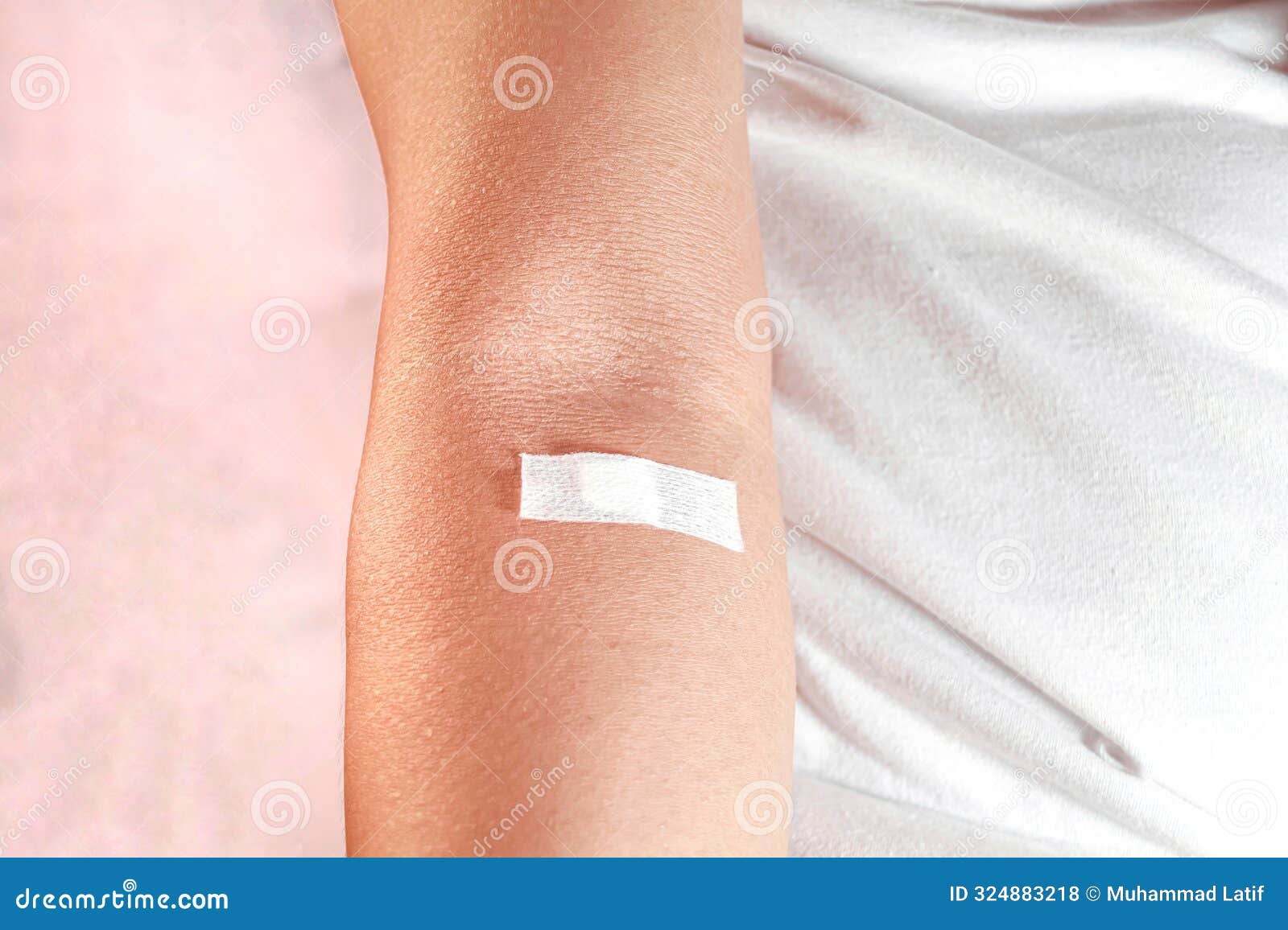 Showing Injection Marks, Concept of Blood Donor Stock Photo - Image of ...