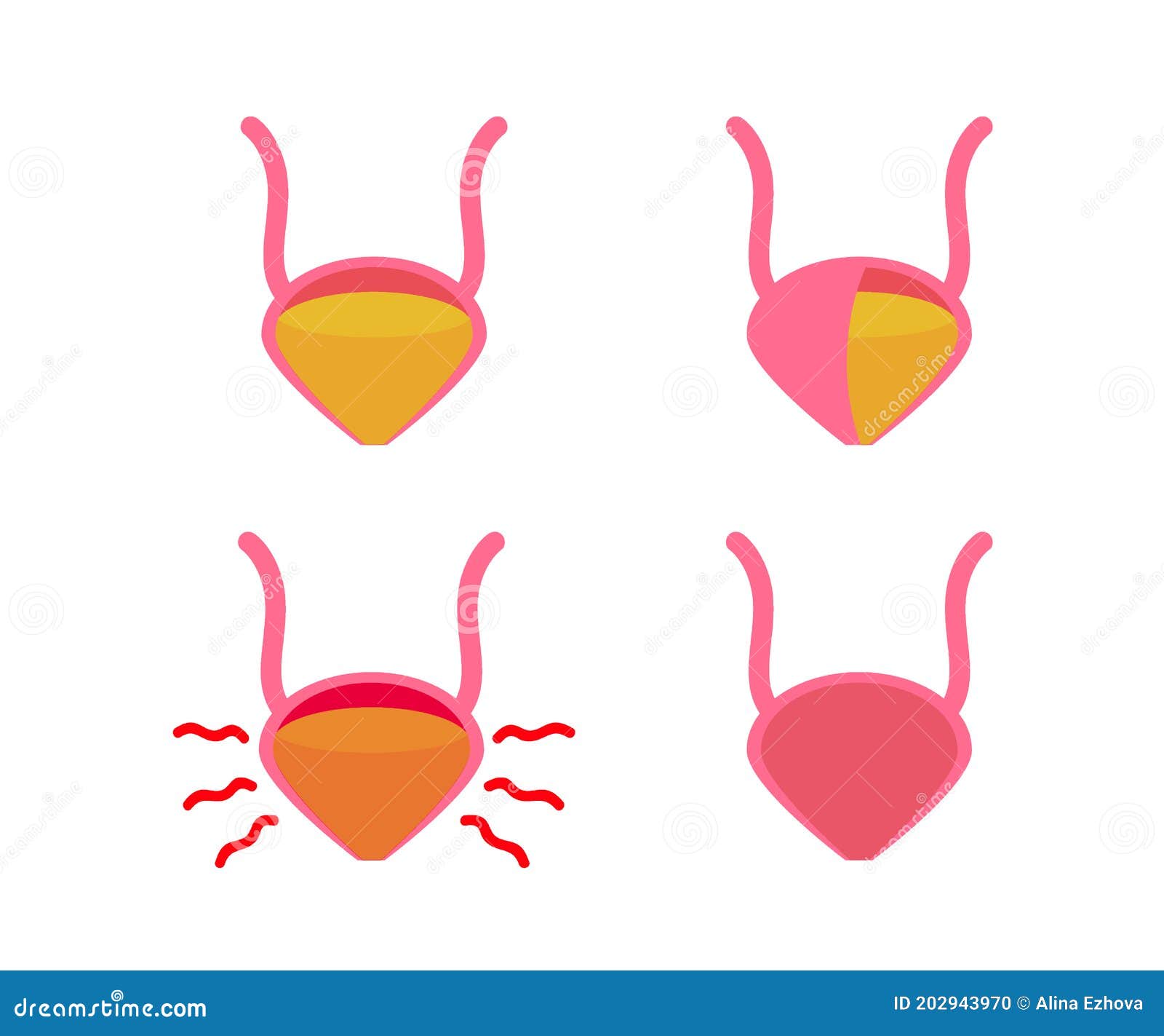 Sick Bladder With Pain Ache Or Disease. Sad Cartoon Character Bladder ...