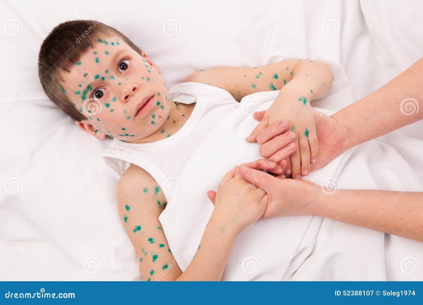 Sick boy in bed stock image. Image of pimple, illness - 52388107