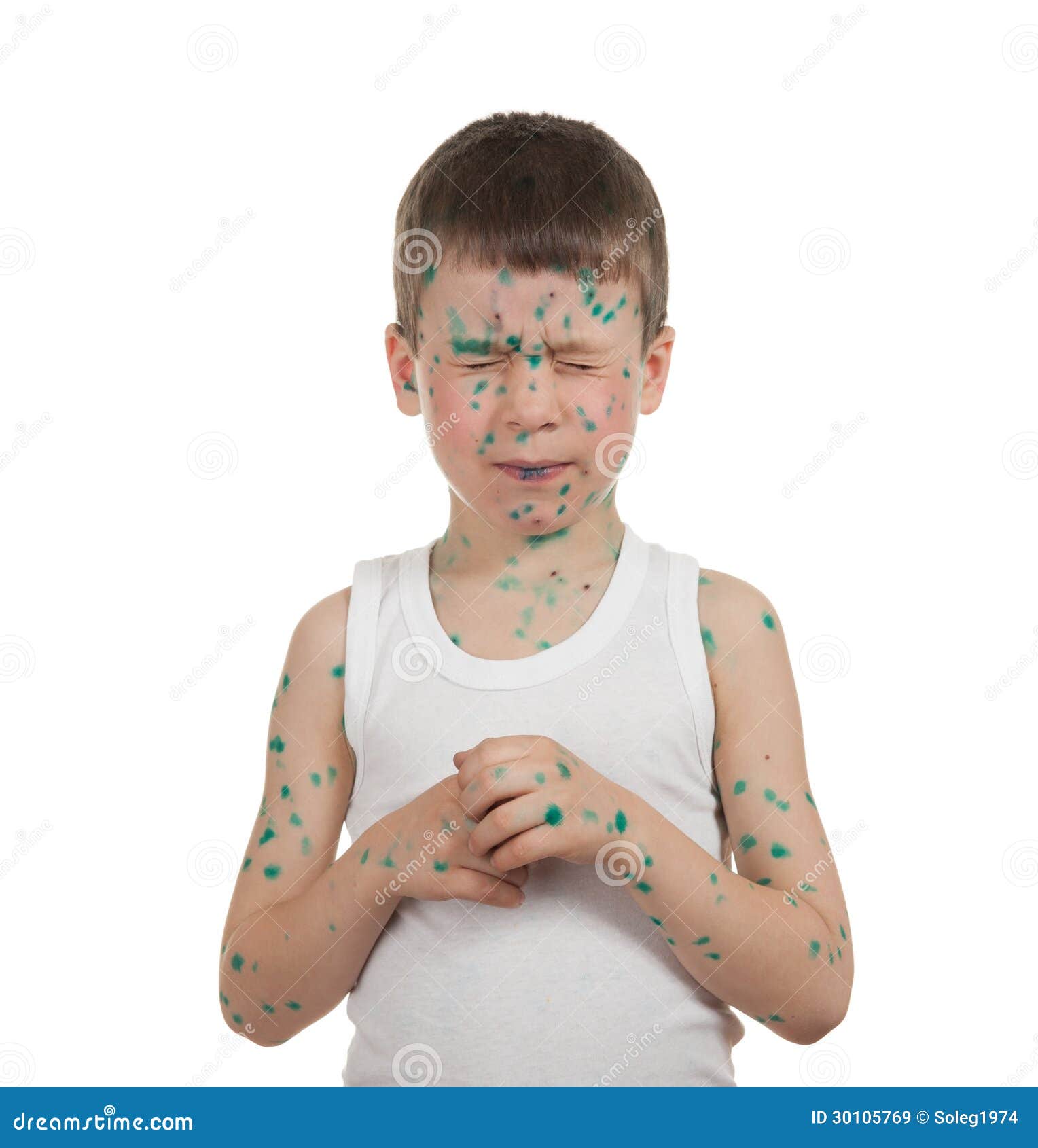 Sick child. chickenpox stock image. Image of brilliant - 30105769