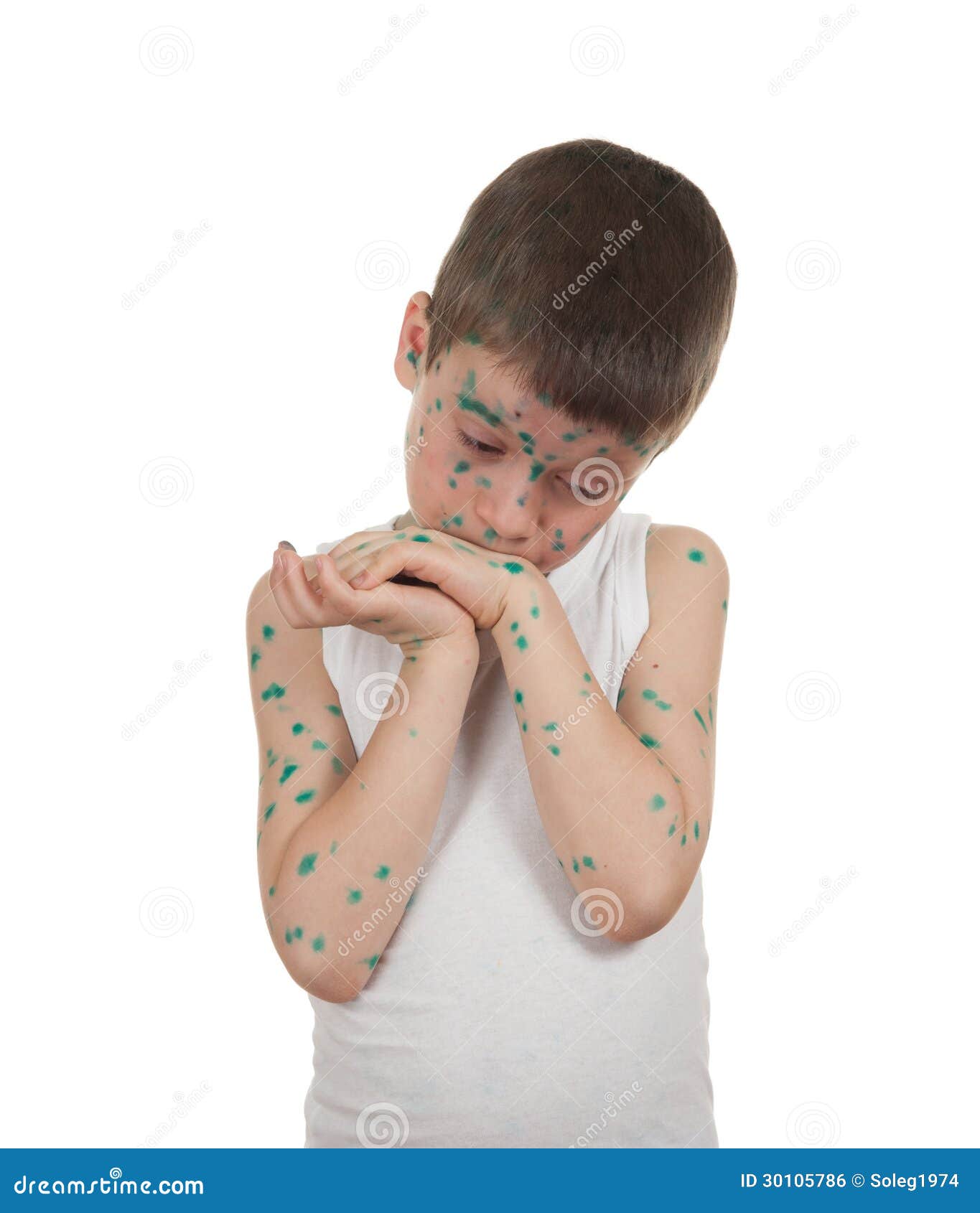 Sick child. chickenpox stock photo. Image of sickness - 30105786