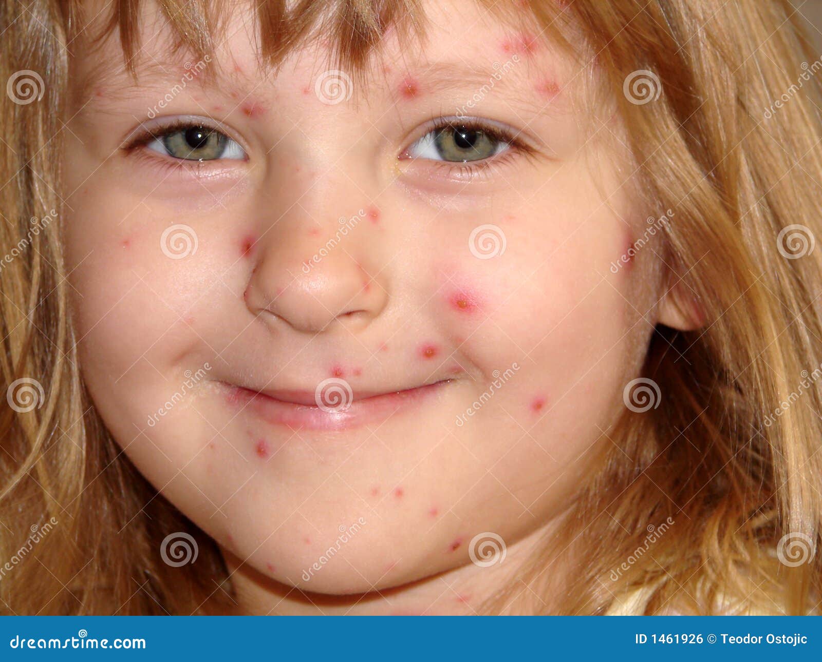 Sick girl stock photo. Image of health, patient, disease - 1461926