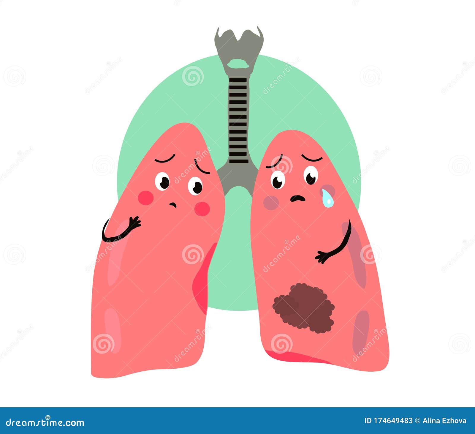 Sick Human Lungs on a White Background. Internal Organ Stock Vector ...