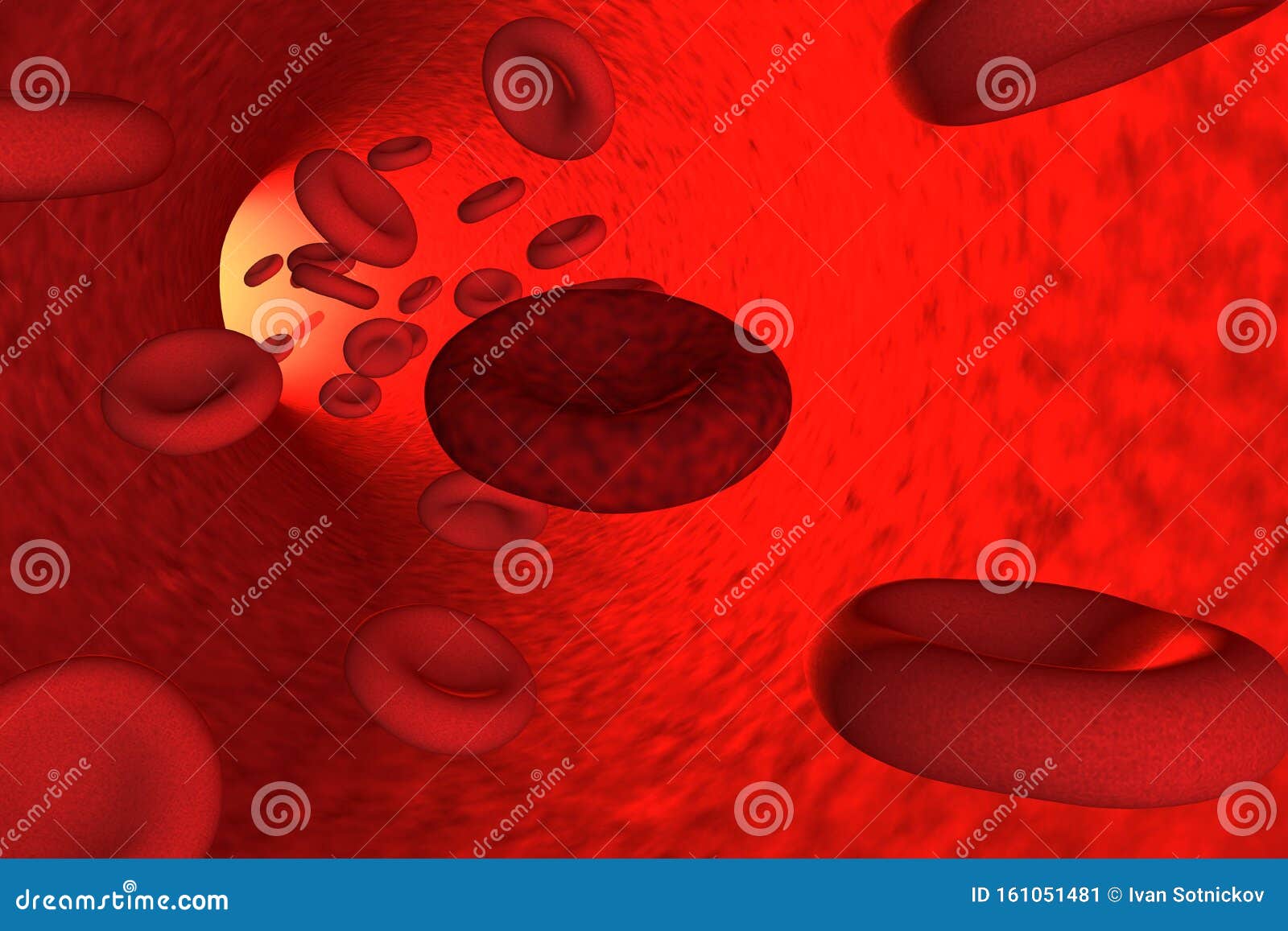 Sick Red Blood Cell with Dark Spots Inside the Artery Stock ...