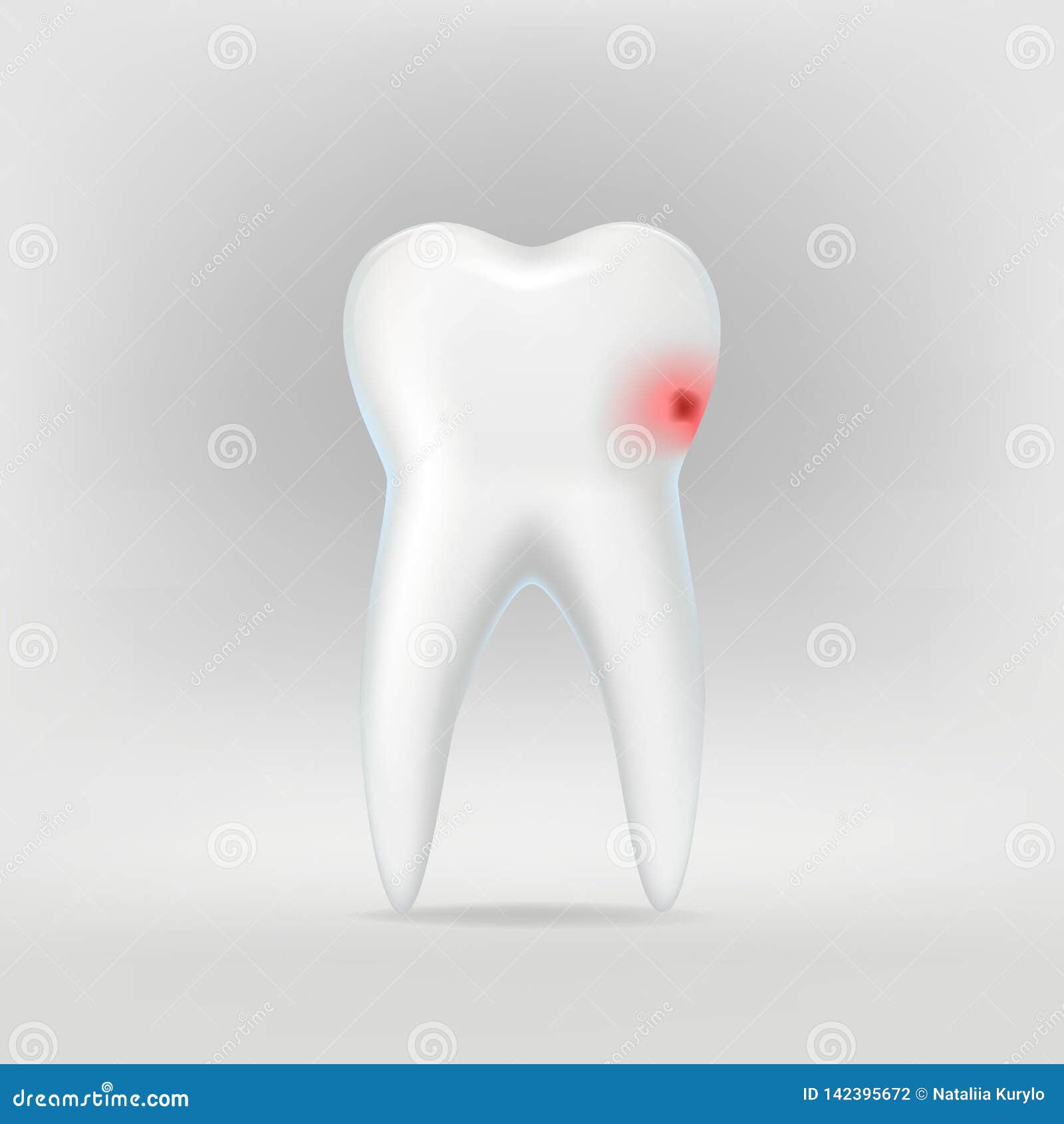 Sick Tooth with Tooth Decay on Gray Background, Vector Illustration ...