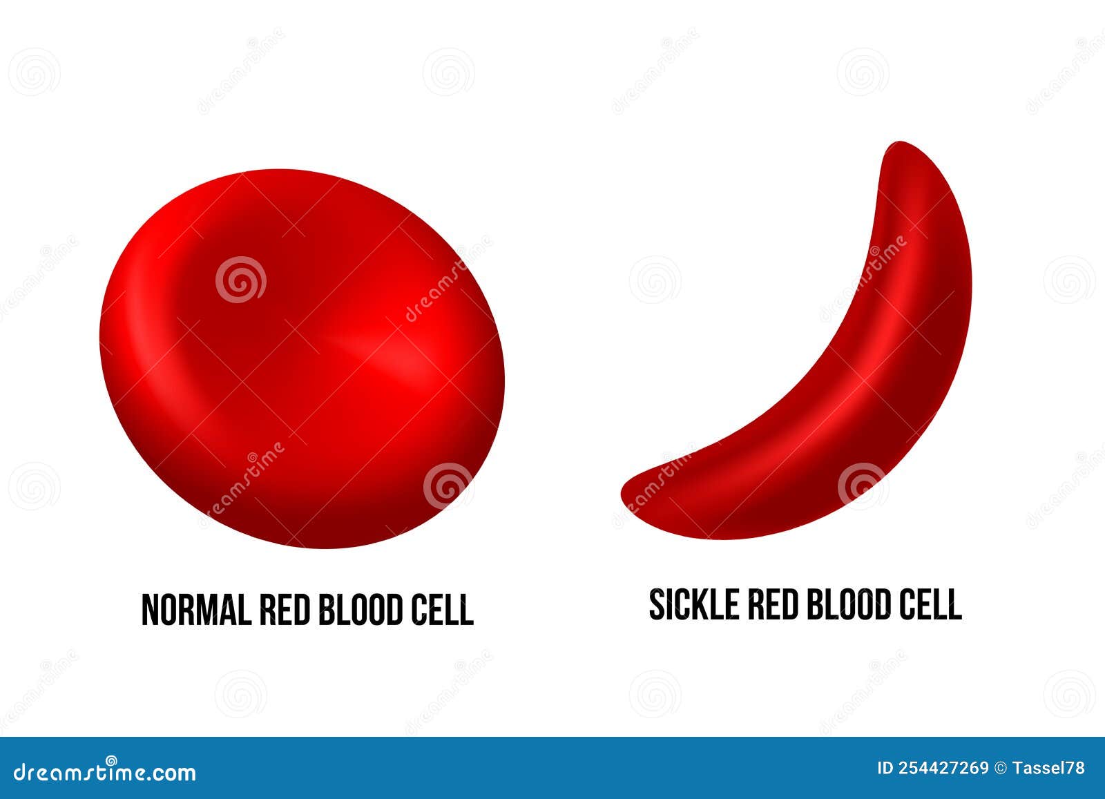 Sickle Cell Disease. The Difference Of Normal Red Blood Cell And Sickle ...